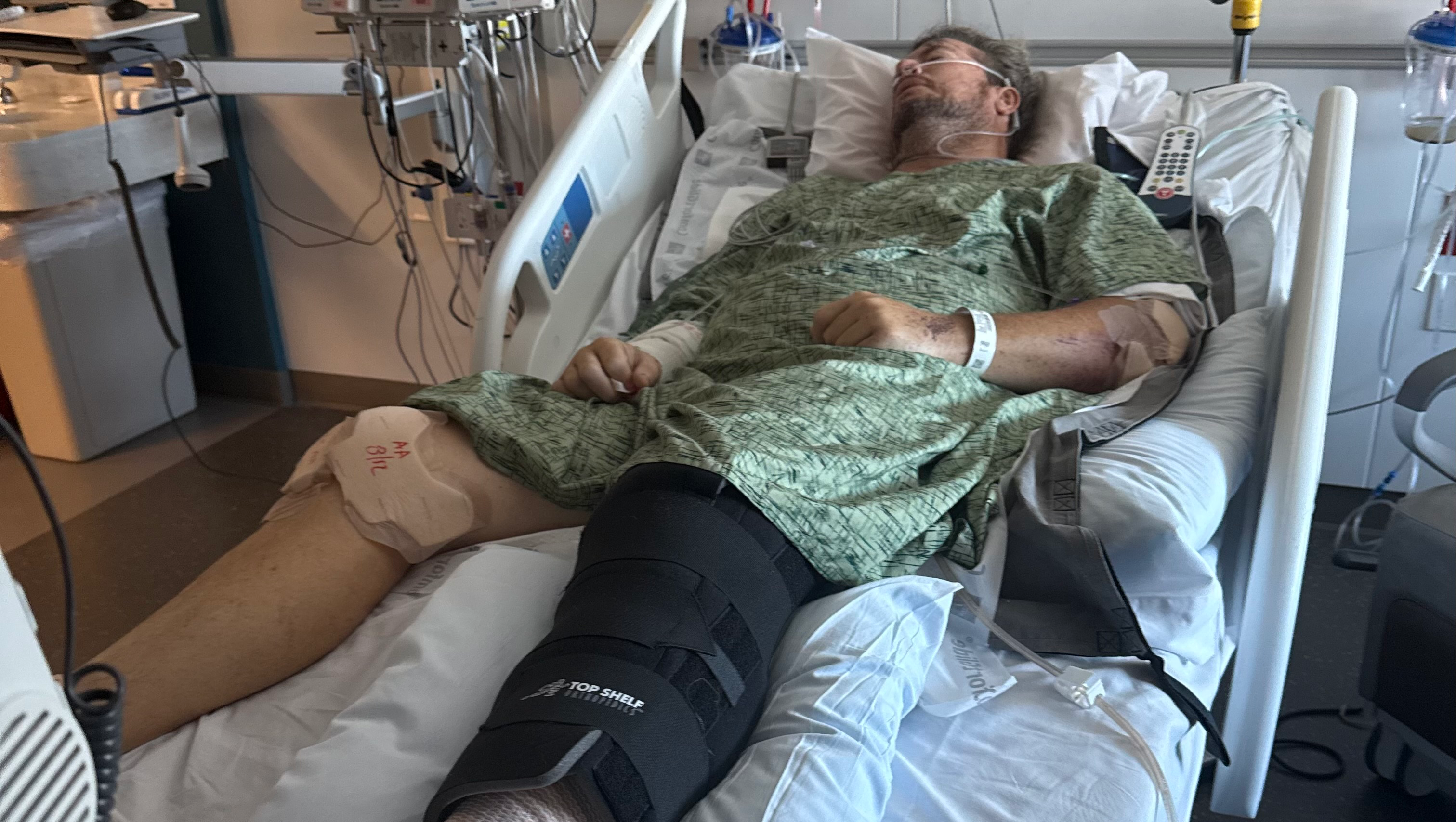 Fundraiser by Tony Short : Support Chriss and Melissa Recovery After Crash