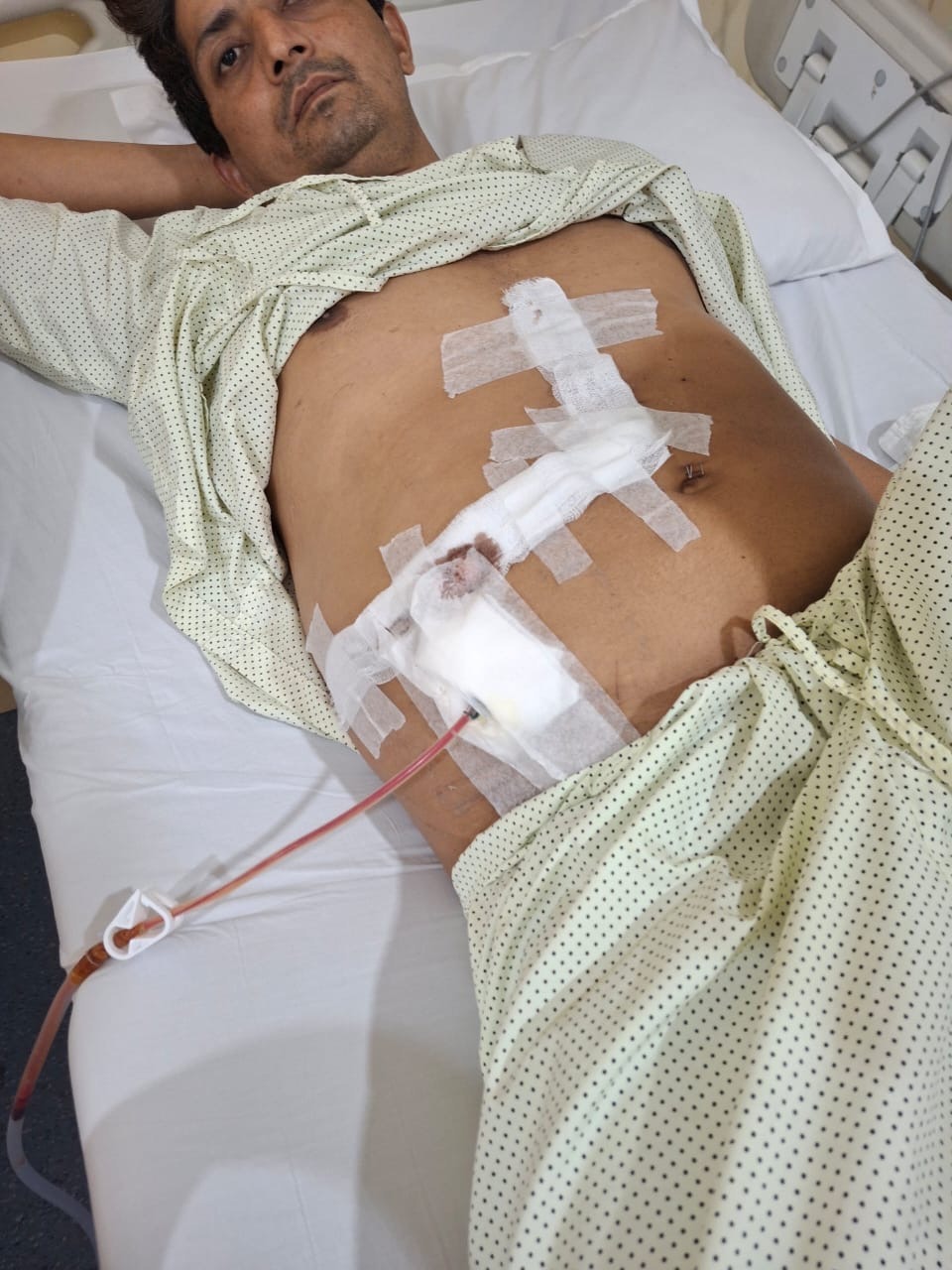 Fundraiser for Ayusha Subedi by Dishant Devkota : Help Govinda in His ...