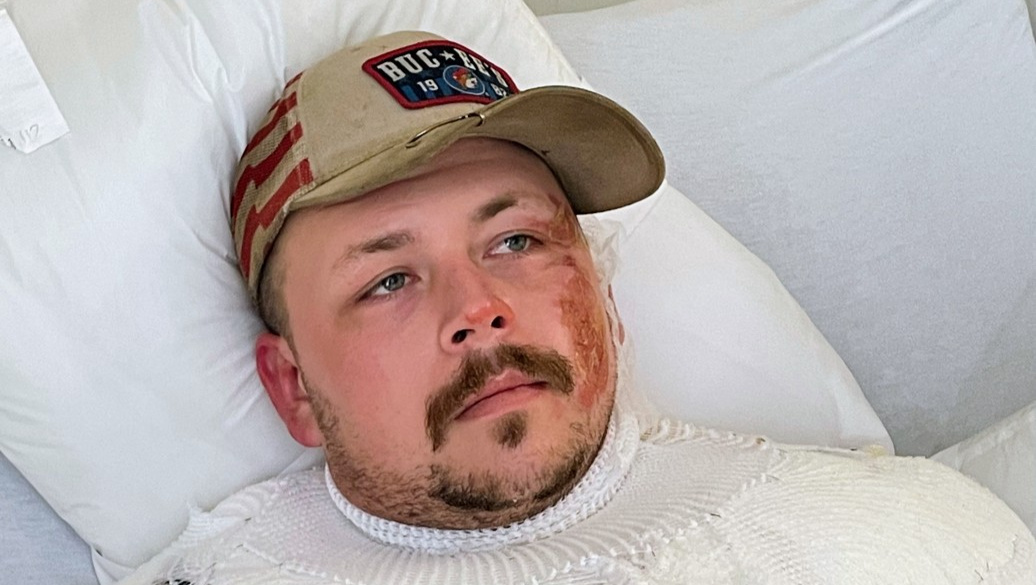 Fundraiser for Megan Tuten by Tyler Beasley : Support Tyler's Burn Journey