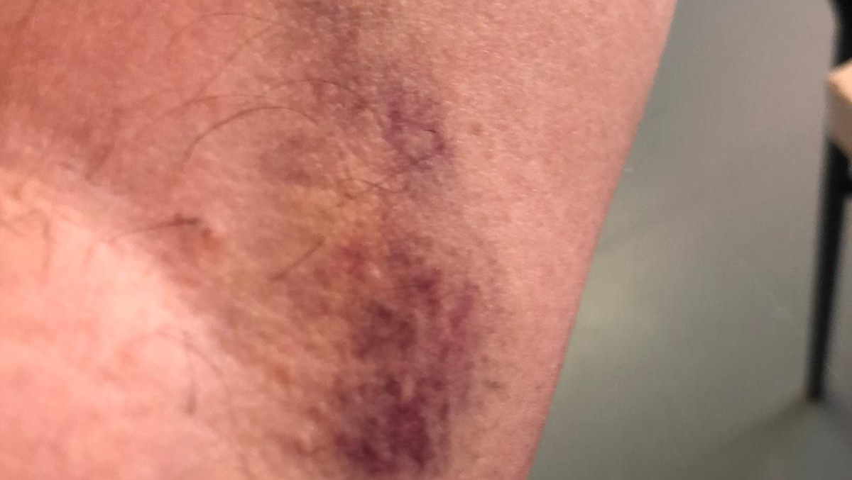 Fundraiser by Marcos Bordi : VeinGo – Chega de sofrer para encontrar uma veia