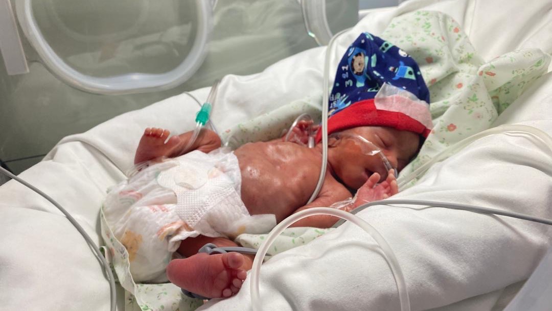 Fundraiser by Butterphly Phunk : Help Baby Ramsey Fight For His Life ...