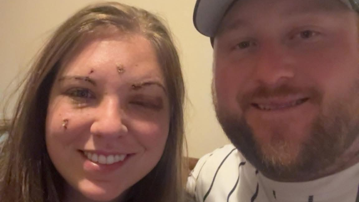 Fundraiser for Melissa Folkert by Daniel Schultz : Help Melissa Folkert ...