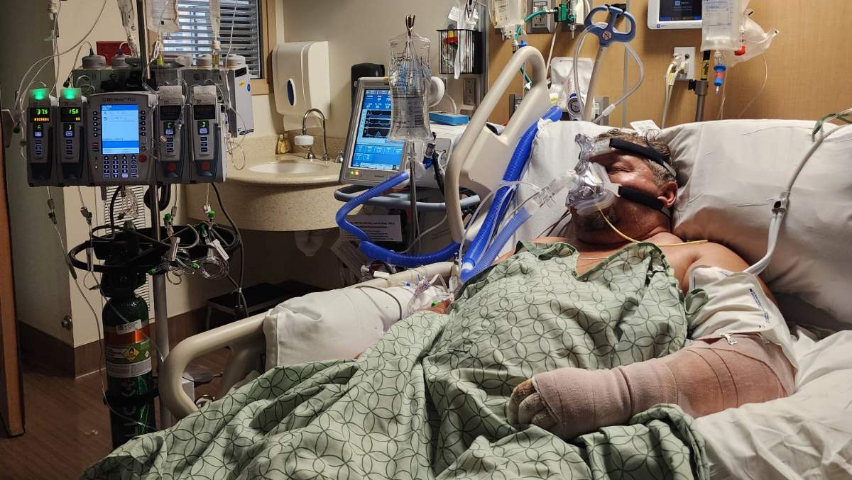 Fundraiser by Yelena Shevchuk : Support Viktor’s Recovery from Body Burns.