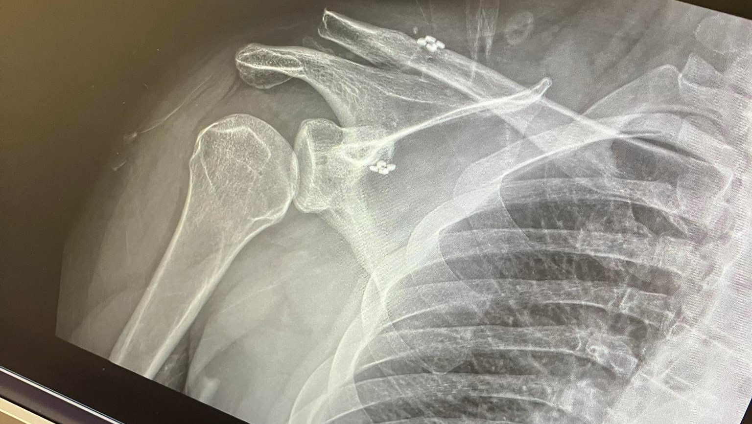 Fundraiser by Kevin Duff : Help my Family Stay Afloat during surgery ...