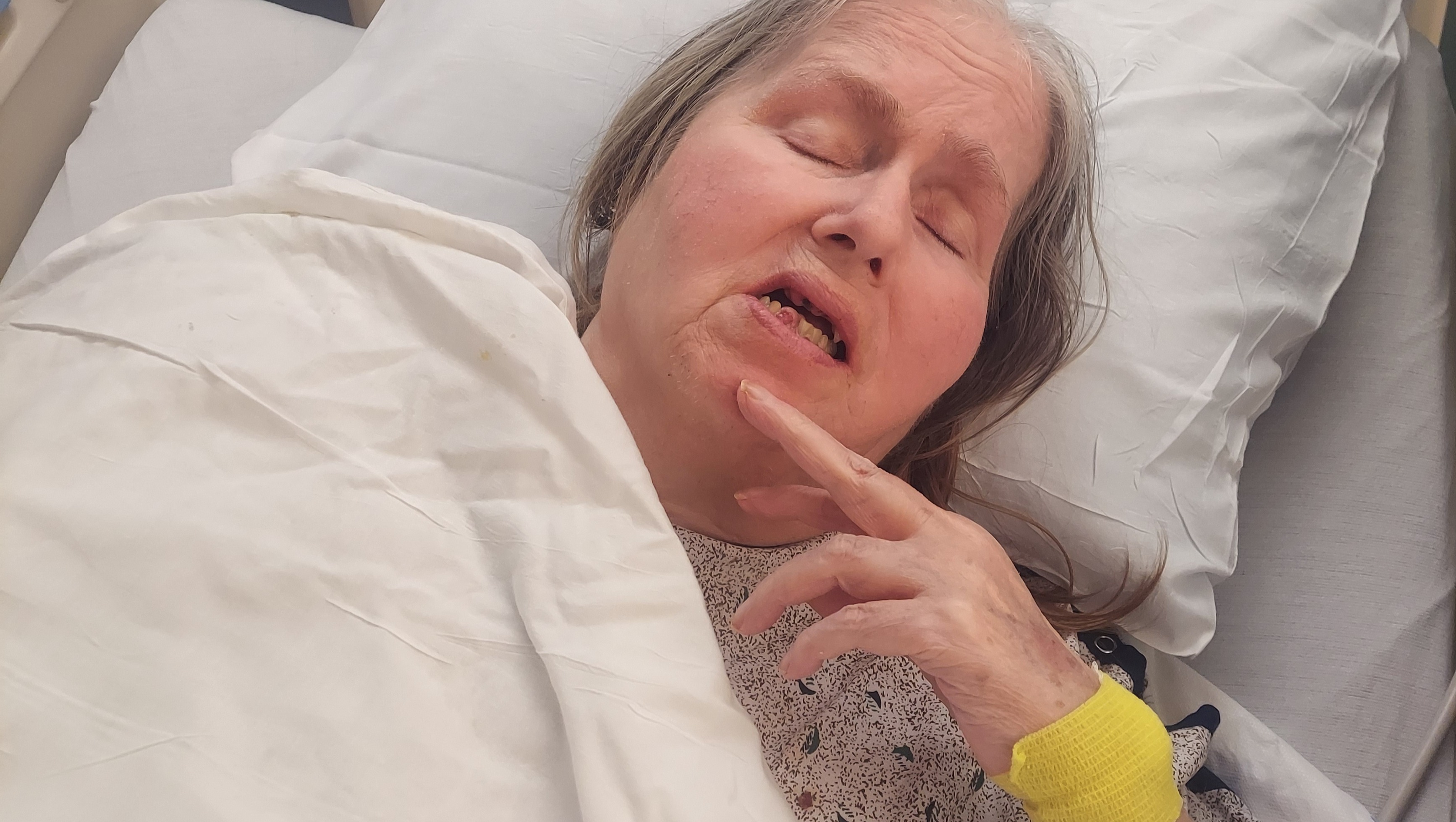 Fundraiser by Robert Flory : Support for Wife's Medical and Dental Needs