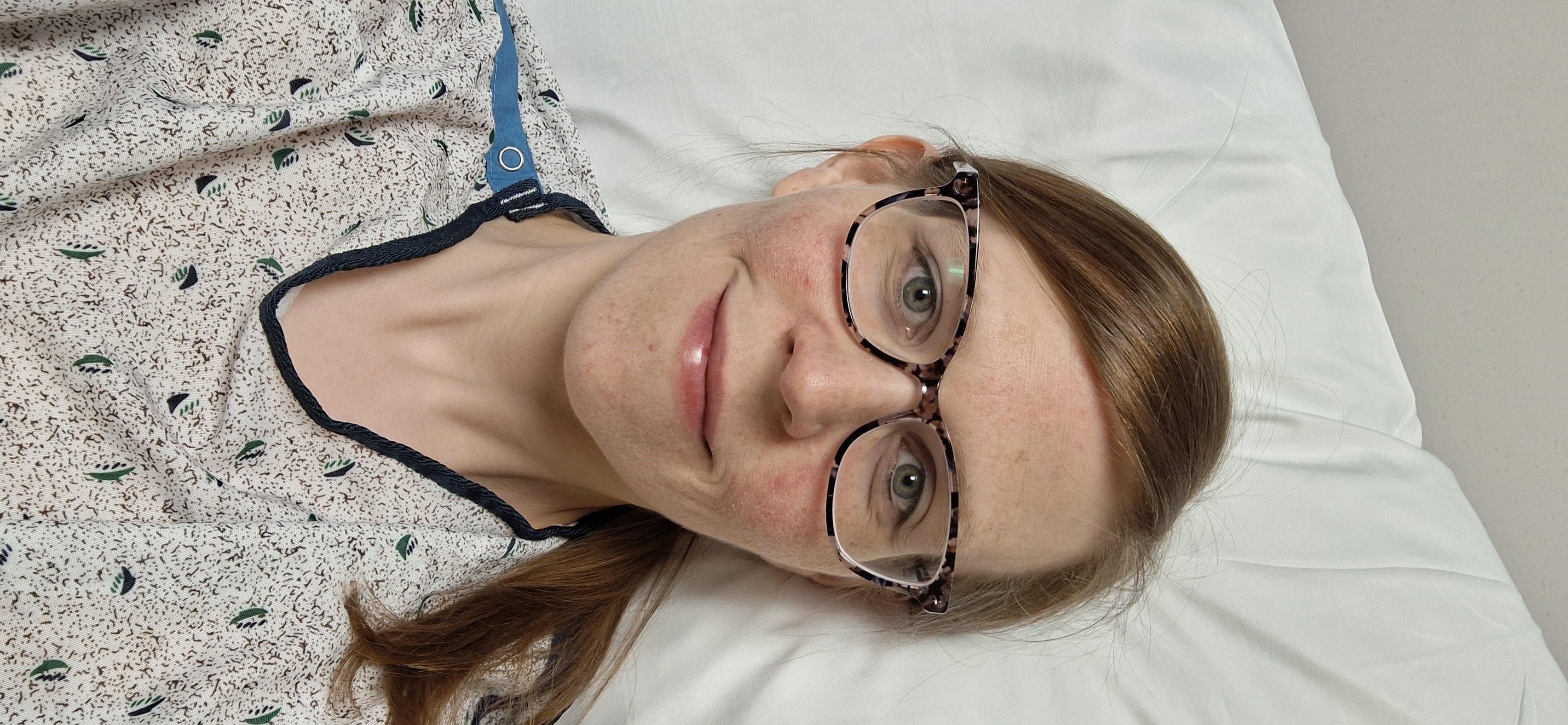 Fundraiser by Holly Cline : Support Holly's Battle with Rare Sarcoid & More