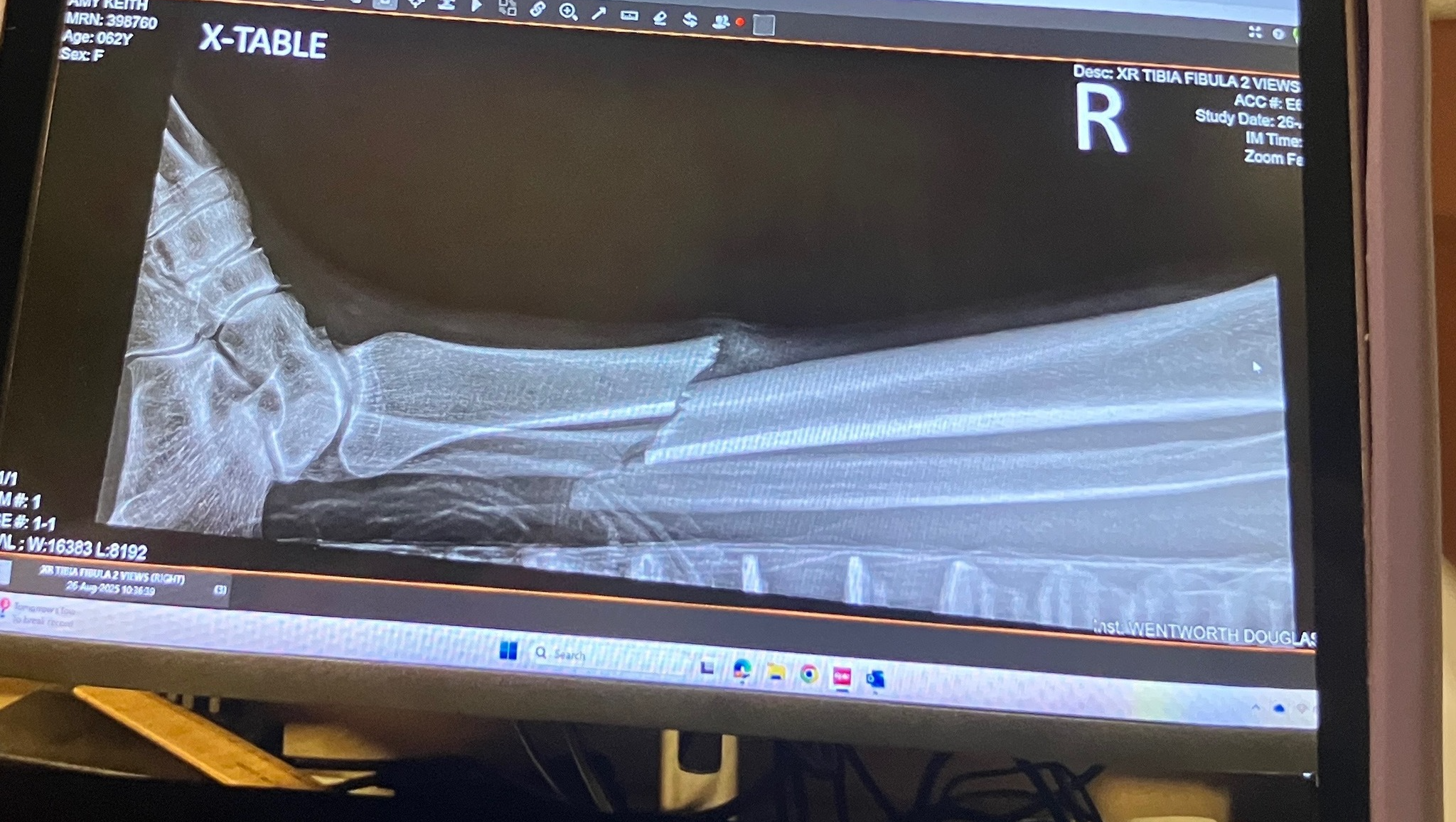 Fundraiser by Amy Keith : Support Amy Keith's Recovery from Horse Accident