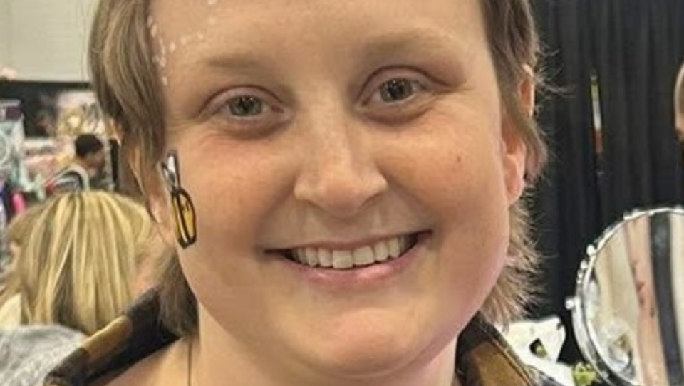 Fundraiser for Sydney Dawes by Charlene Daub : Help a girl to live her ...