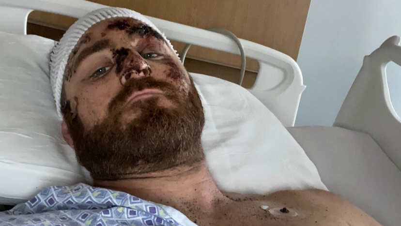 Fundraiser by Greg DZIKOWSKI : Help Mike Barry Walk Again After Tragic ...