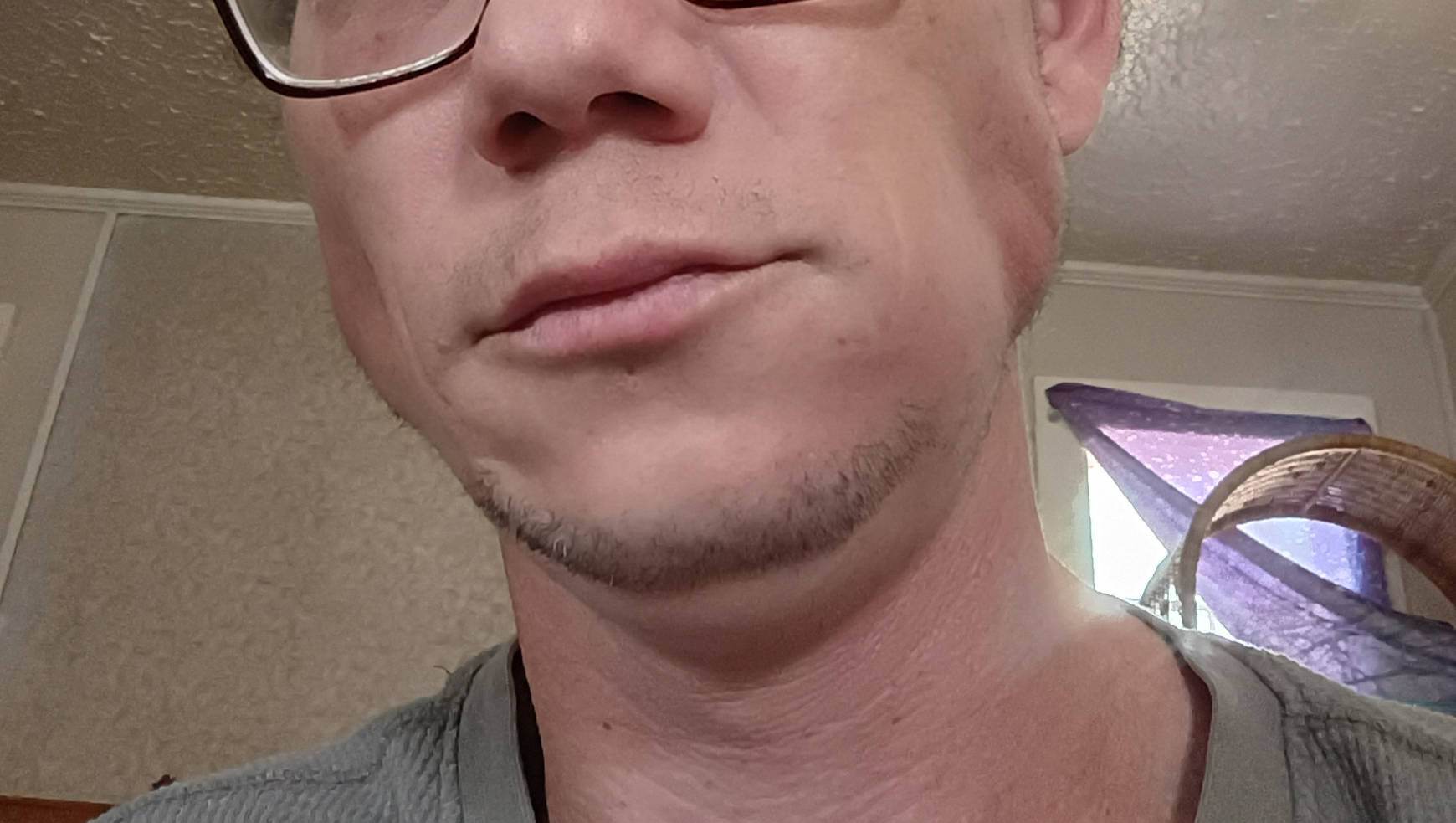 Fundraiser by Aaron Dewees : Donate to help with abscess removal surgery