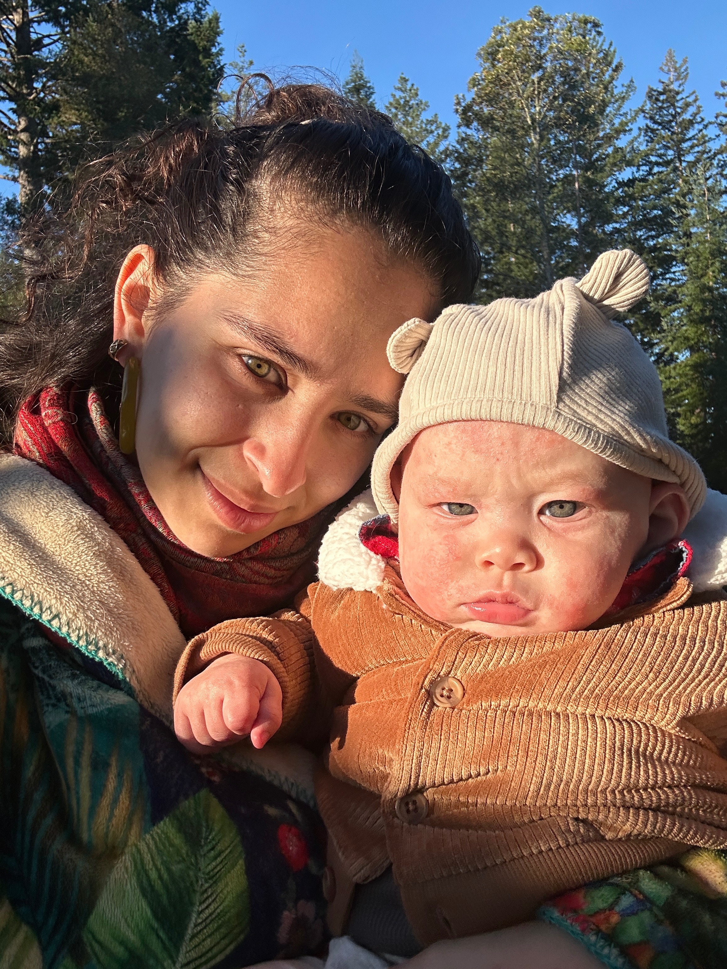 Fundraiser by Zoe Atlas : Support Baby Jacob Healing Severe Eczema