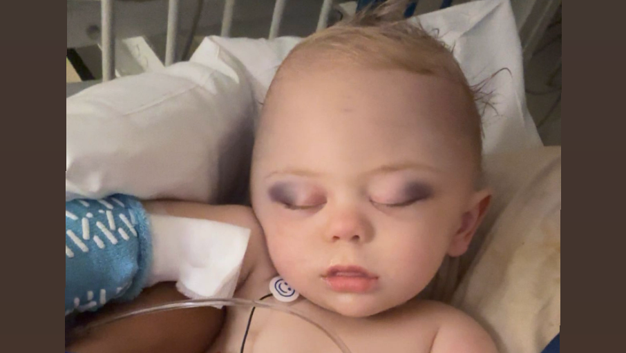 Fundraiser by Terry Hickman : Support Rowan's Skull Surgery Journey