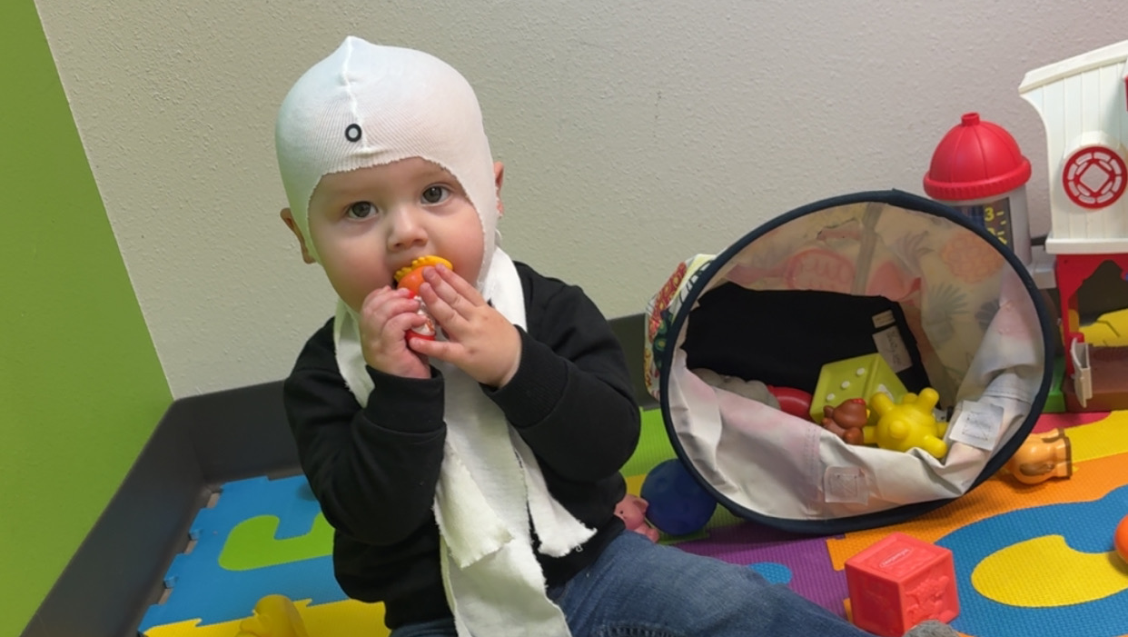 Fundraiser by Kayla Pilkenton : Help Asher Get His Cranial Helmet