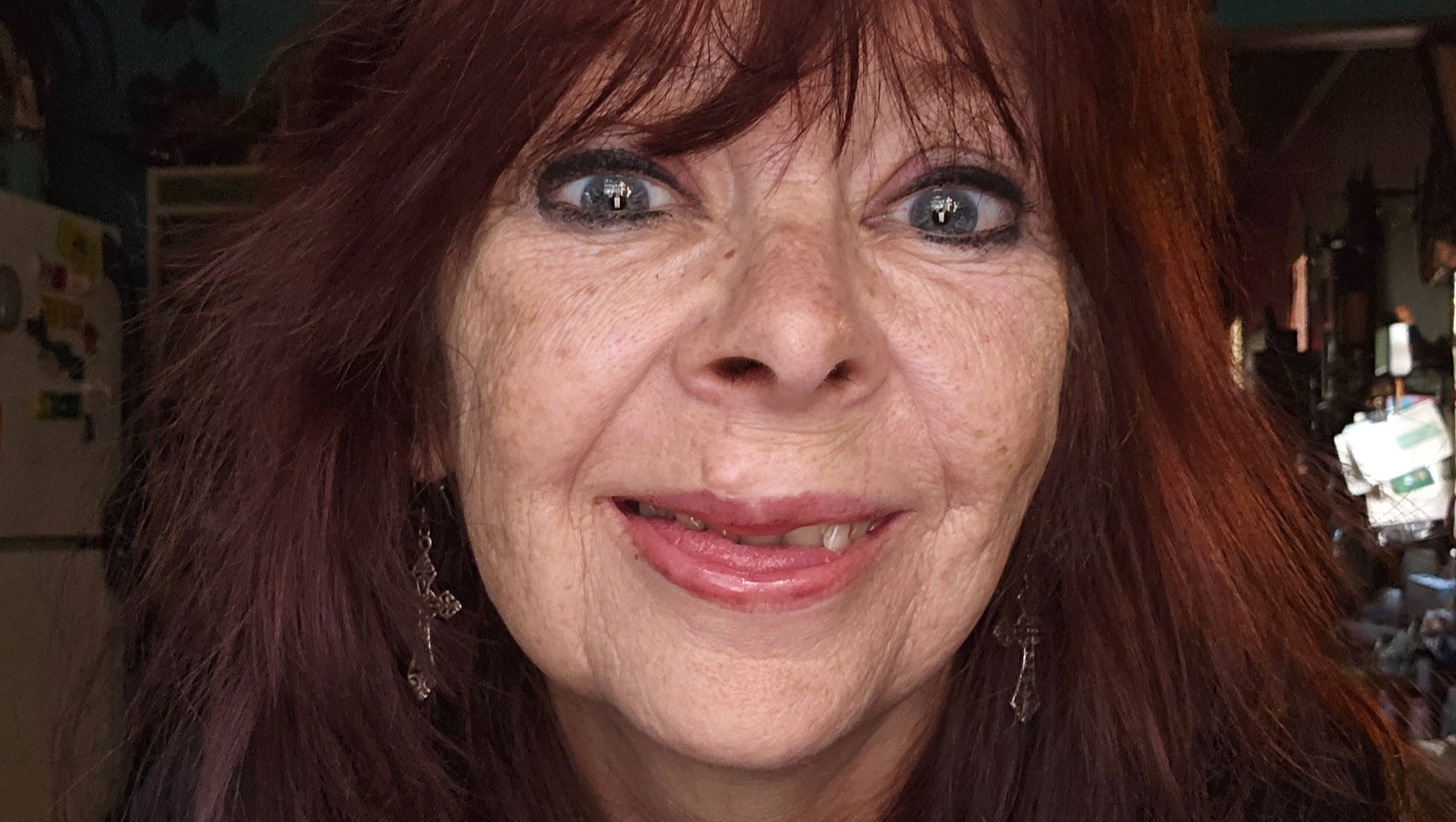 Fundraiser by Diana See : Help Support Diana's Dental Expense From ...