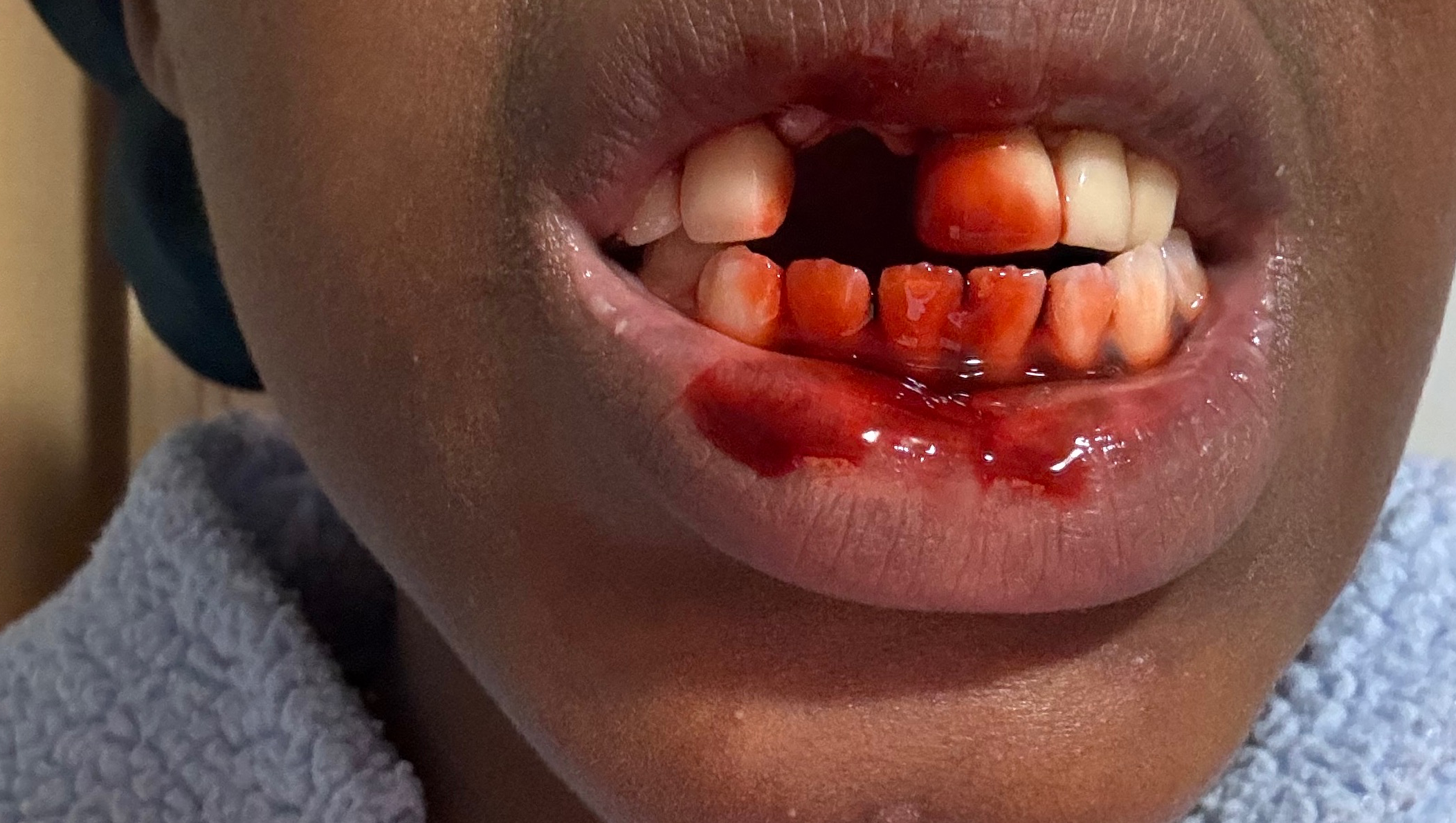 Fundraiser by Elizabeth Oyebode : Help Liz get a new smile