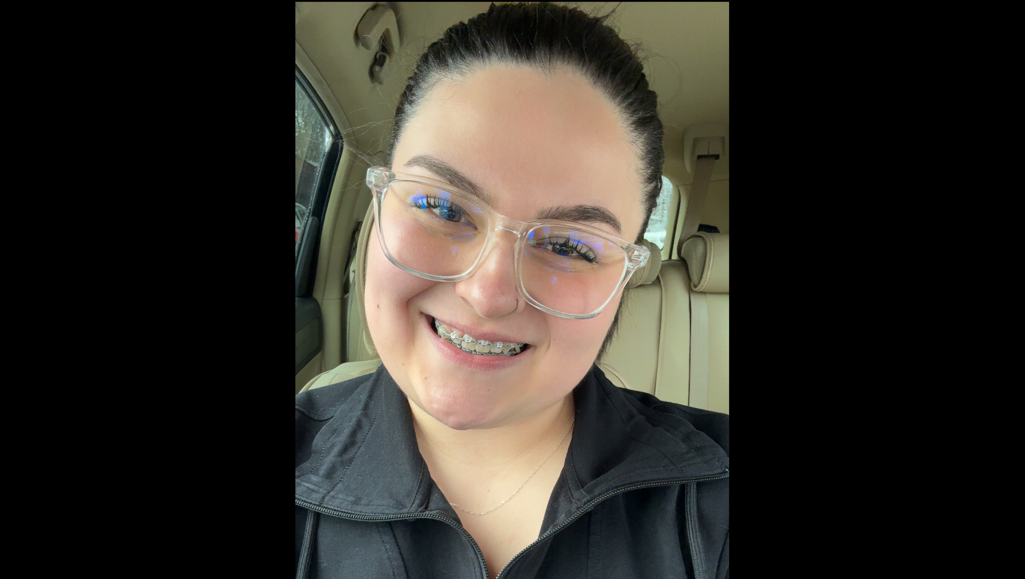 Fundraiser by Sarah Smith : Sarah pay for her surgical tooth implant.