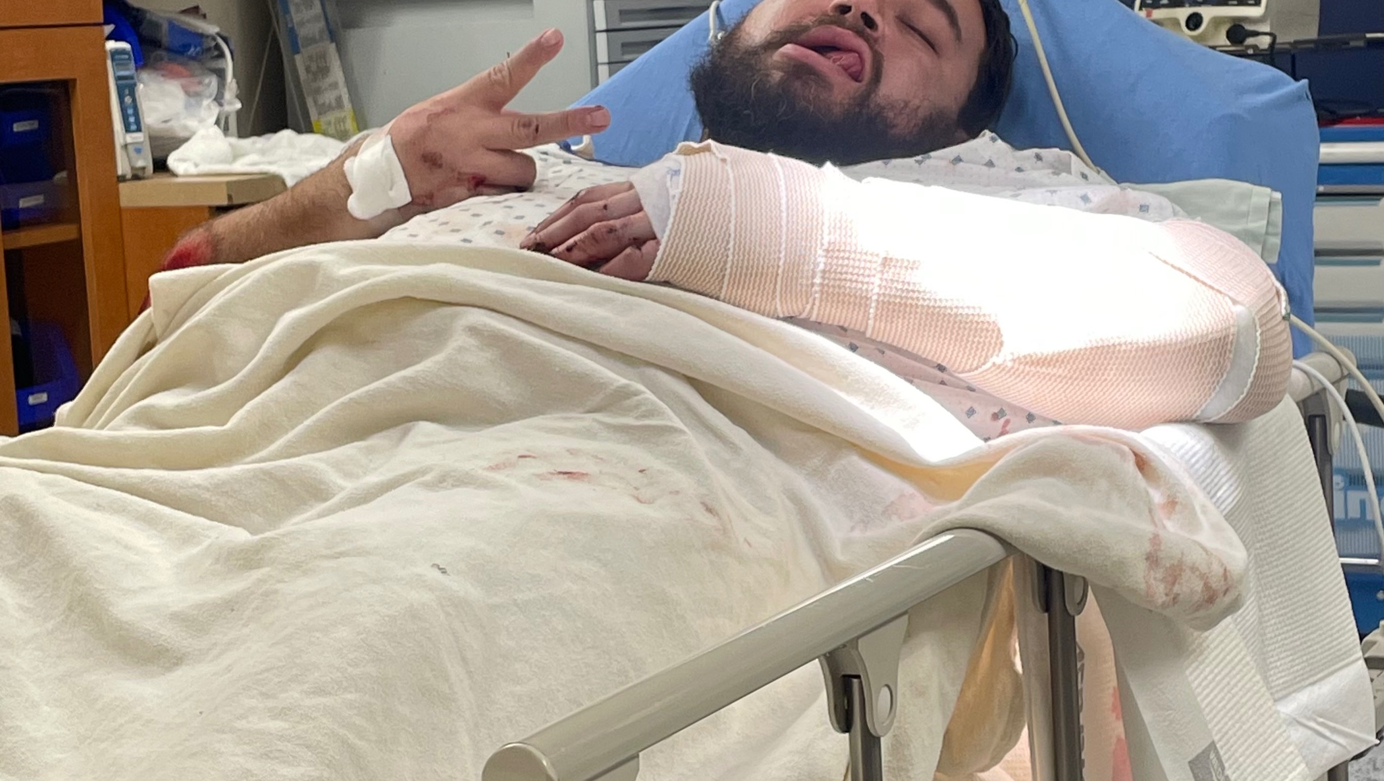 Fundraiser by Brenda Sanchez : Support Jose “Big Papi” Sanchez’s Hand ...