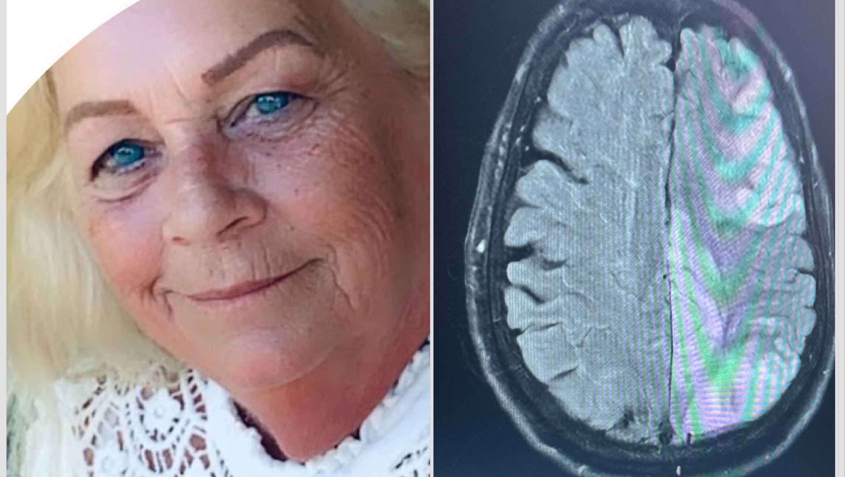 Fundraiser by Kassi Evers : Help my mom’s stroke recovery process.