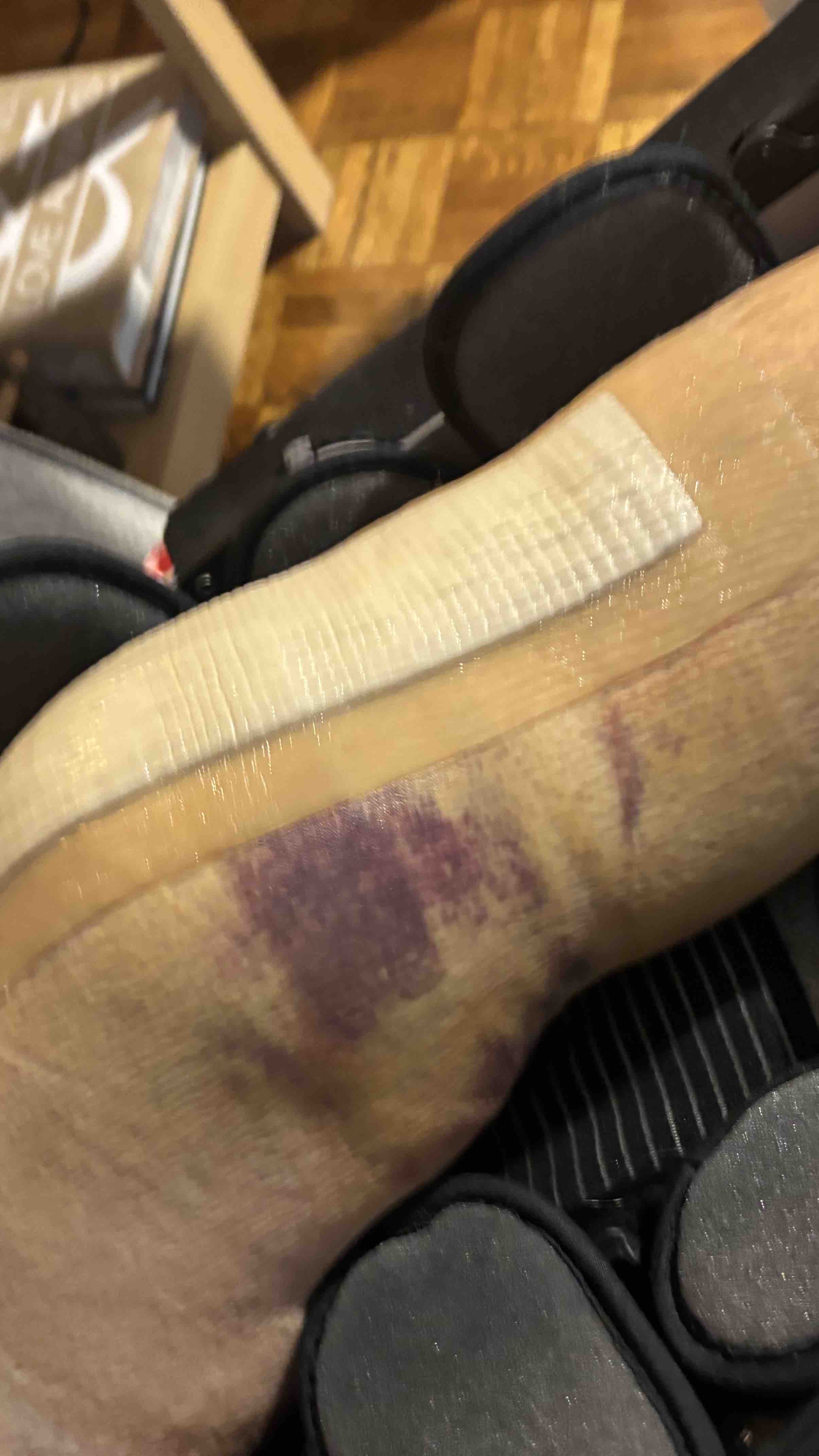 Fundraiser by Chris Roth : Support Recovery After Major Knee Surgery