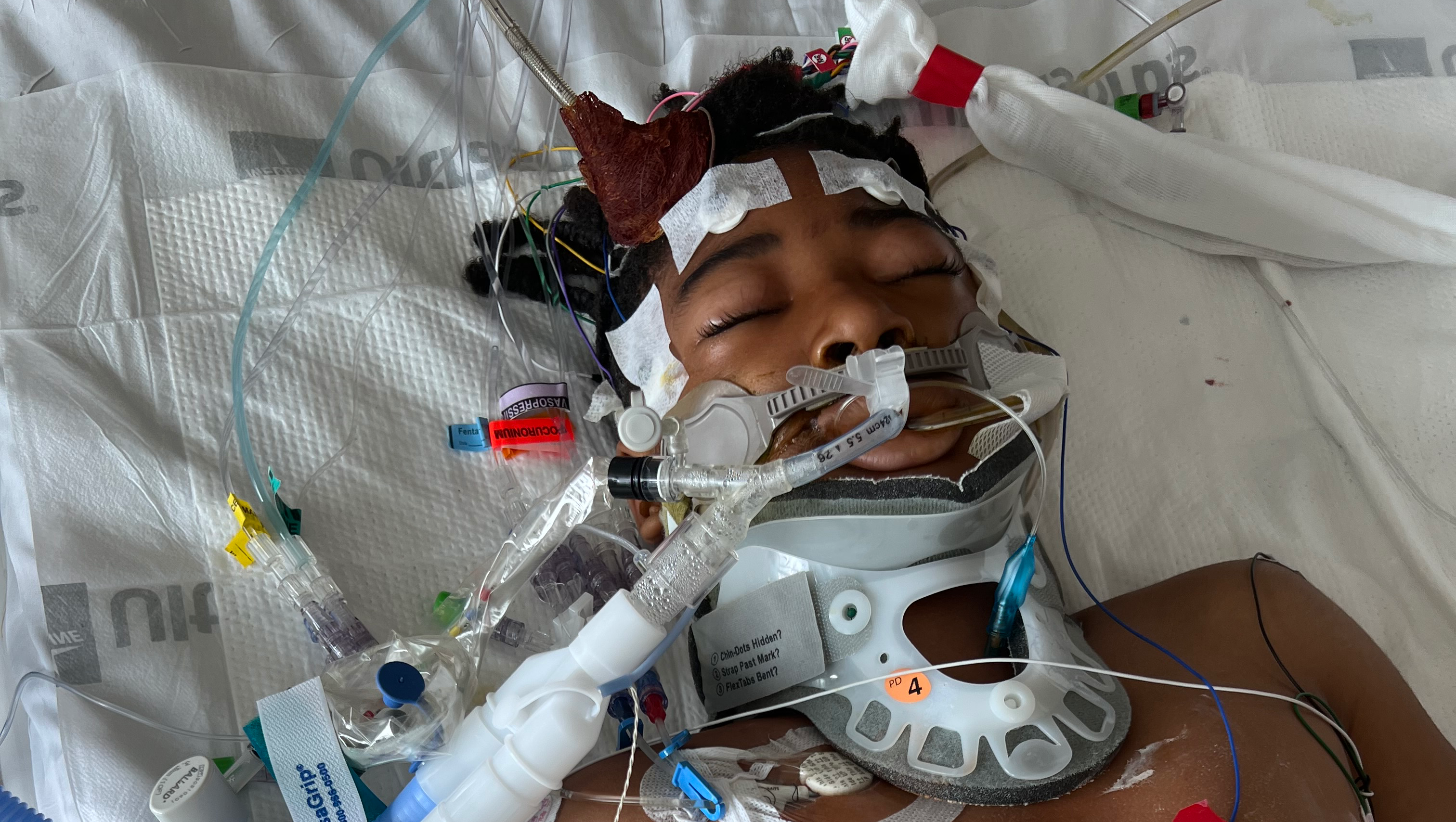 Fundraiser for Andrea Dallas by Cherilyn Davis : Aid Amari's Healing ...