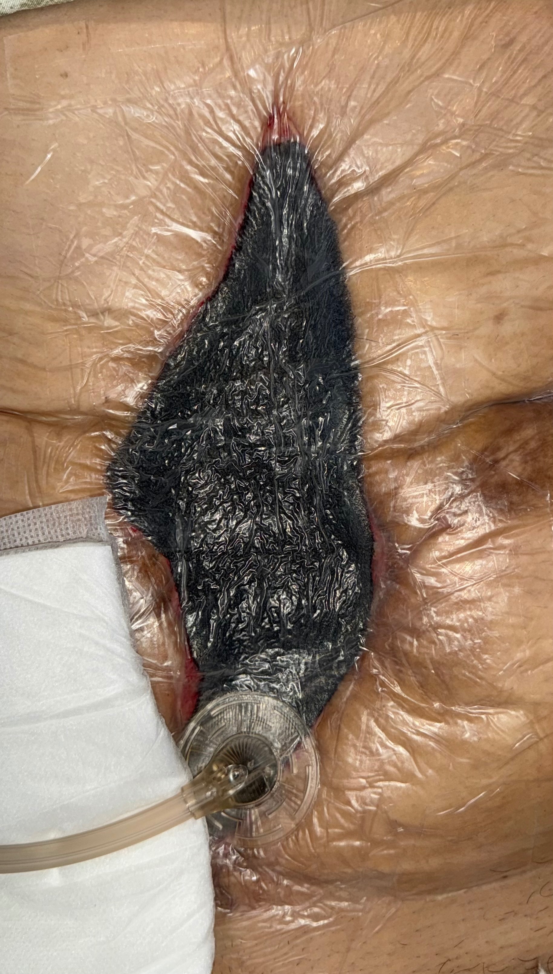 Fundraiser by Jessie Natkong : Support Jessie's Healing Journey