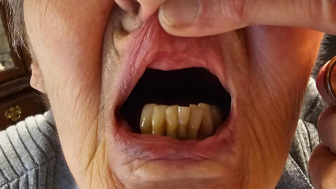 Fundraiser by Dave Rutan : Help Support Sondra's Essential Dental Surgery