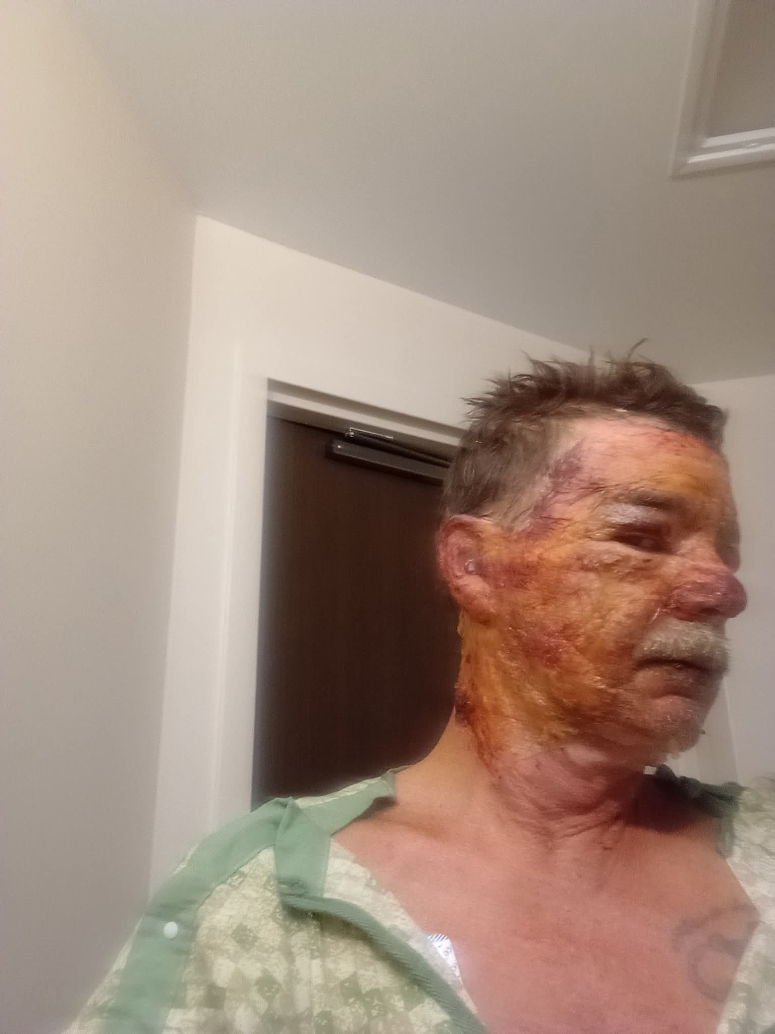 Fundraiser by Bryan Ferrell : Help the Reddings Overcome Medical and ...