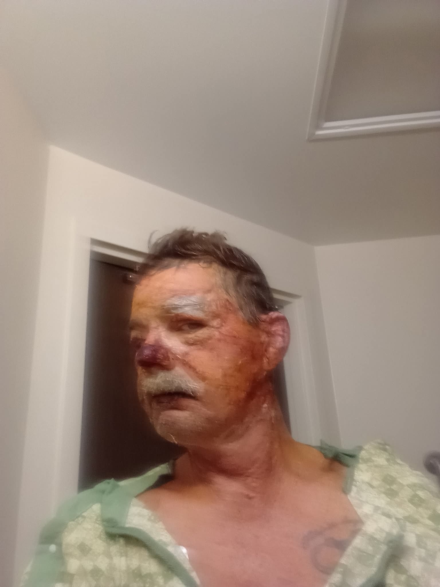 Fundraiser by Bryan Ferrell : Help the Reddings Overcome Medical and ...