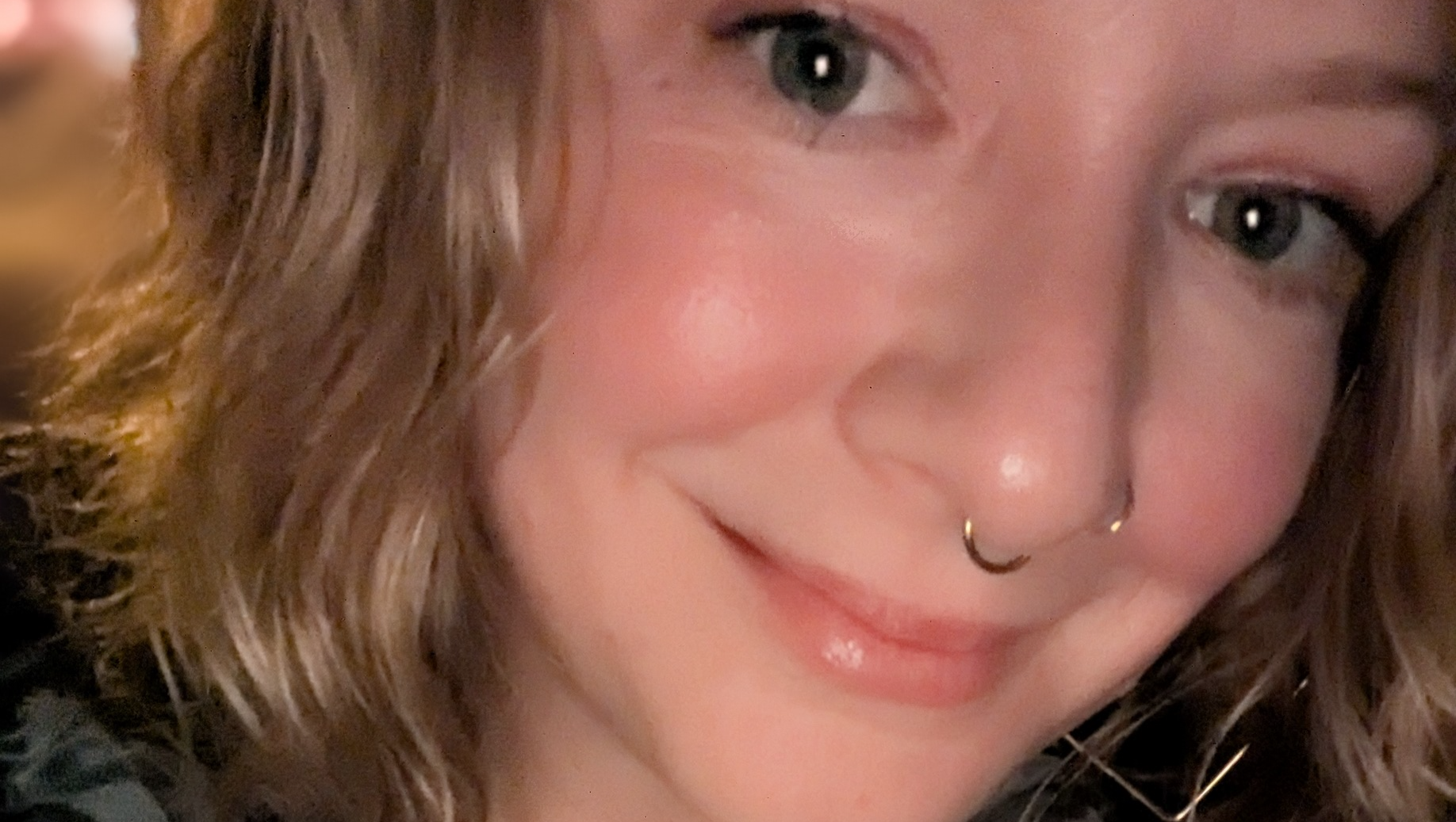 Fundraiser by Amy Luke : Support Amy's Spinal Fusion Recovery