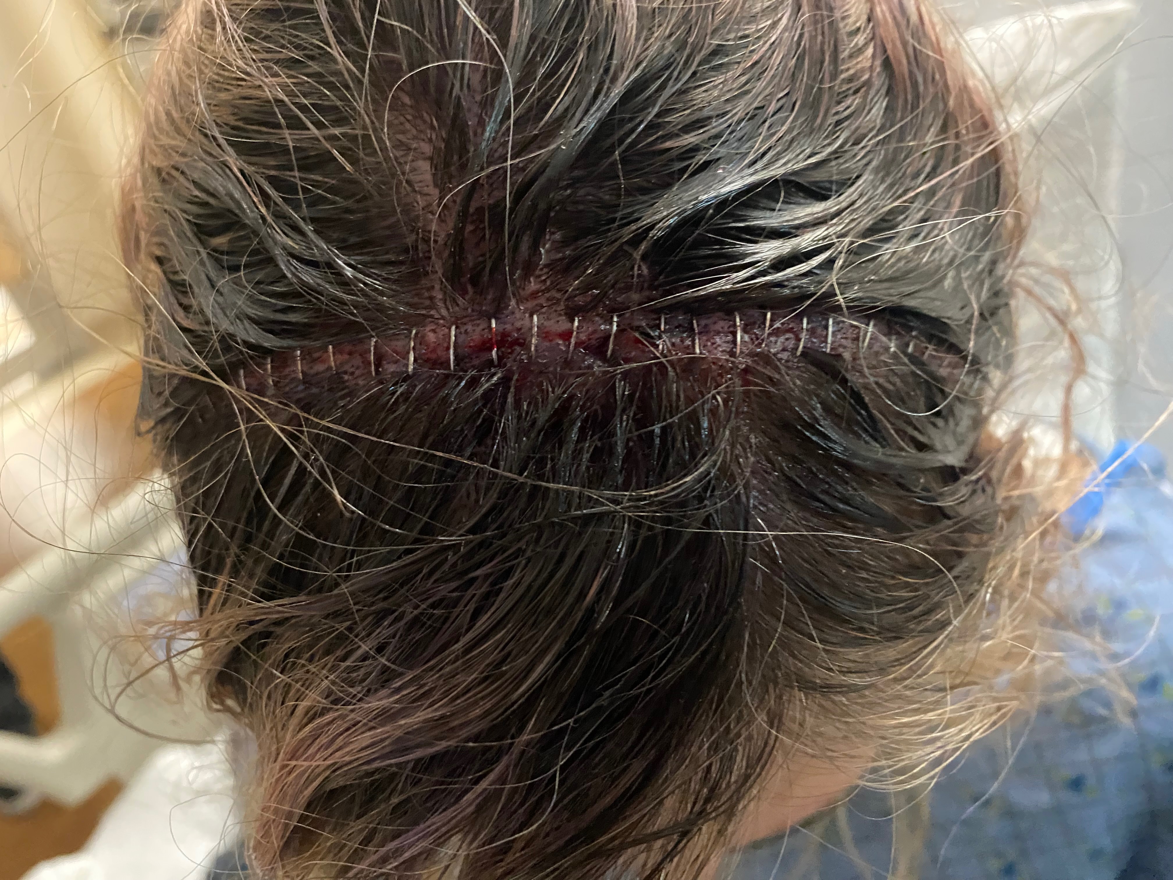 Fundraiser for Mandy Erickson by Carrie Patton : Support Mandy ...