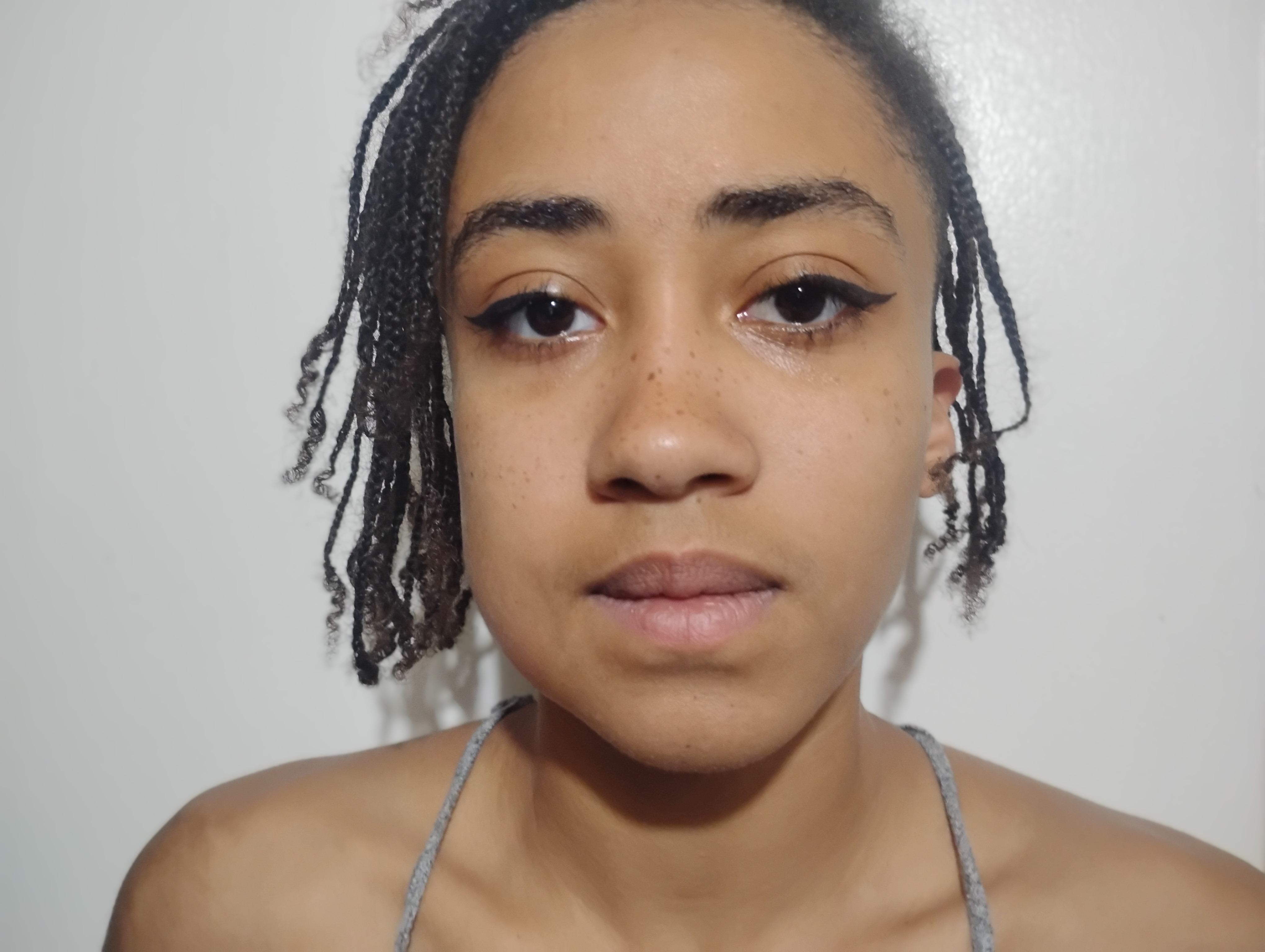 Fundraiser by Hannah Hutchinson : Help Me Smile Again: Wisdom Teeth ...