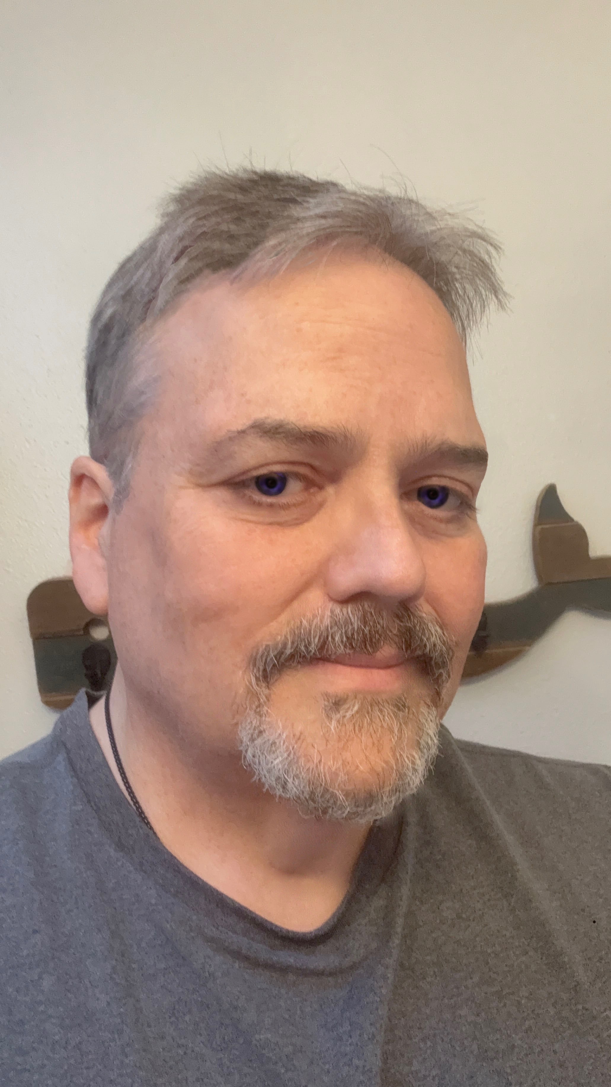 Fundraiser by David McIntyre : Support David McIntyre's Life-Saving ...