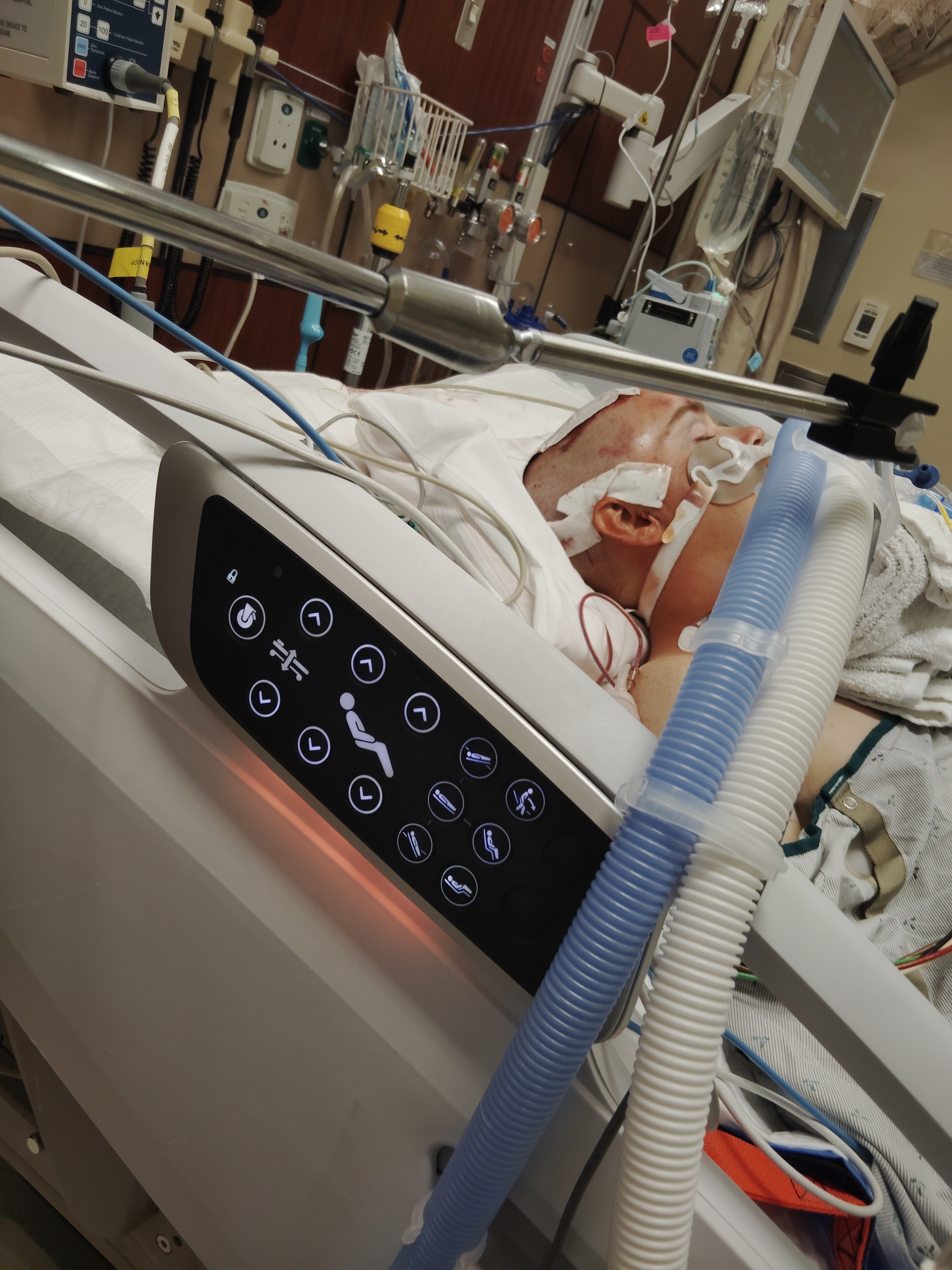 Fundraiser by Dusty Childers : Support Hayden McBryde's Long Road to ...