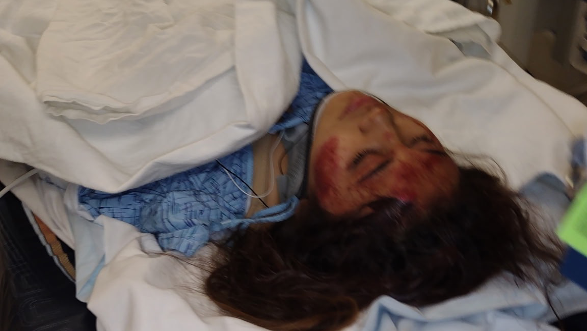 Fundraiser by Melissa Helmkamp : Support Azmira's Recovery After Tragic ...