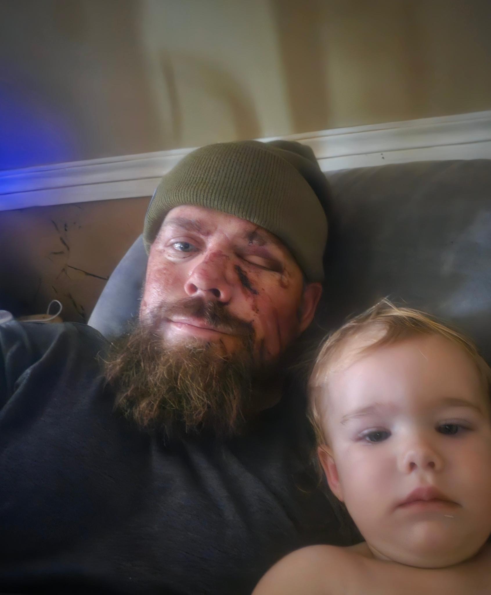 Fundraiser by Morgan Dawson : Support Daniel and Family After ATV Accident