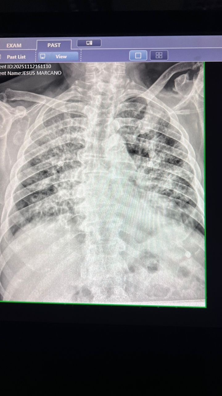 Fundraiser by Maria Marcano : Ayuda para Jesús Marcano Ortega