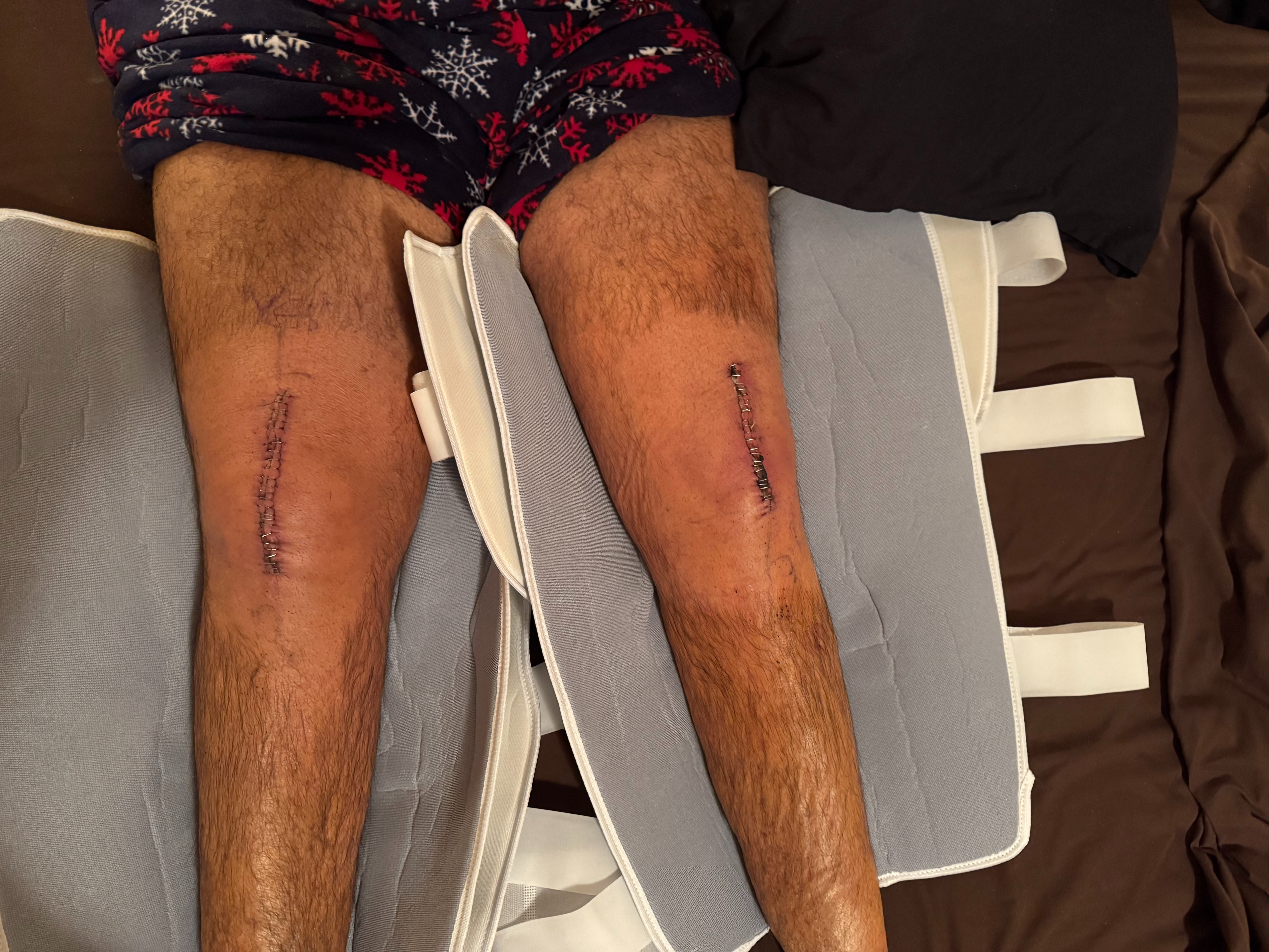 Fundraiser for Peter Fonseca by Lisa Lugara : Please Help Support my ...