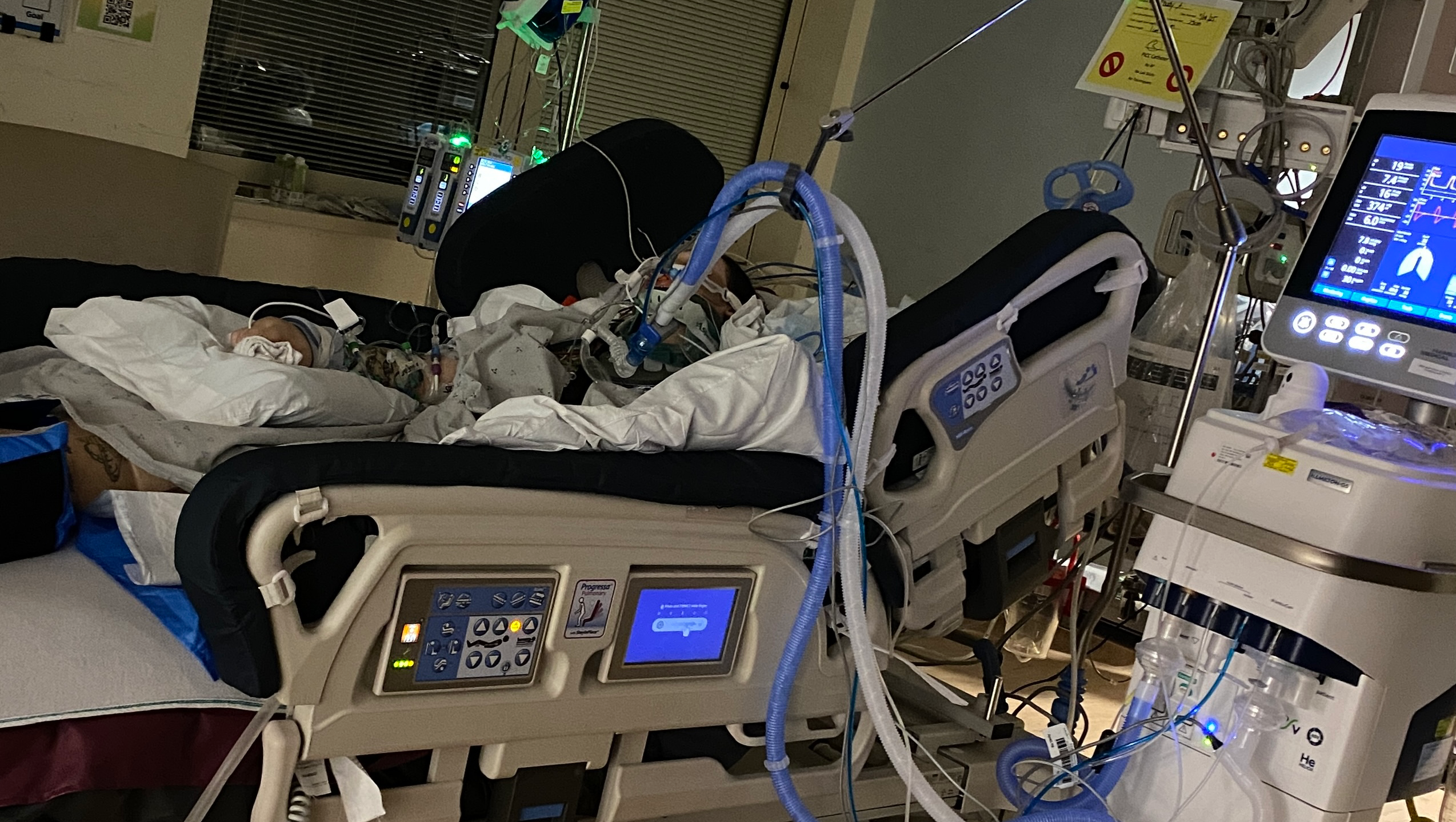 Fundraiser by Oliver Rhudy : Allie Is Fighting for Her Life After a ...