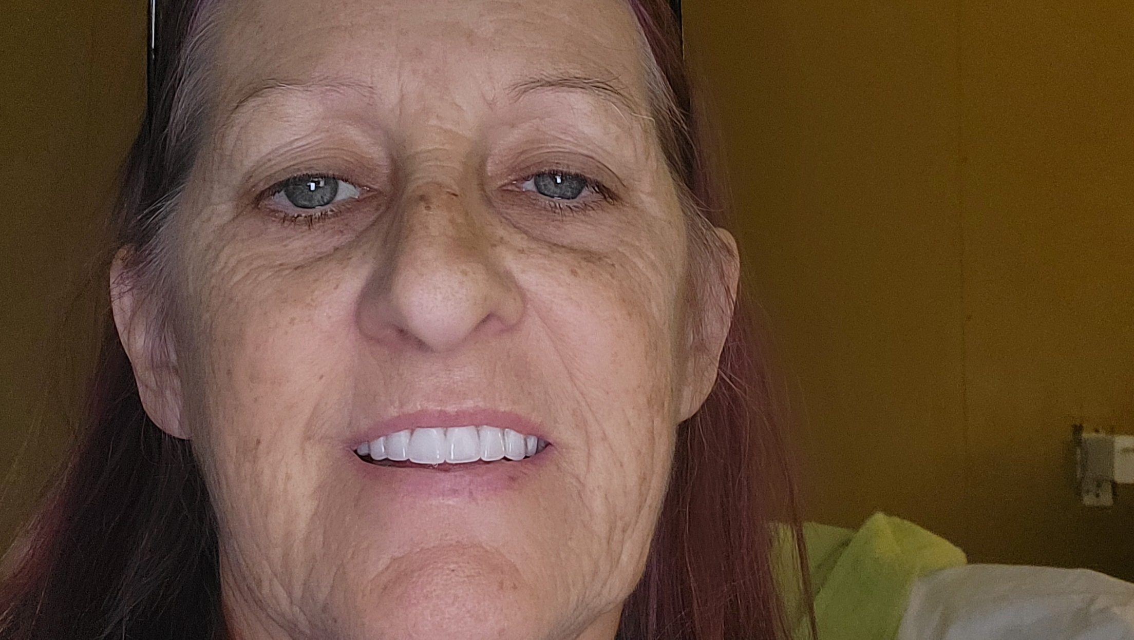 Fundraiser by Catherine Burns : Support Cat Burns' Heart Surgery Recovery