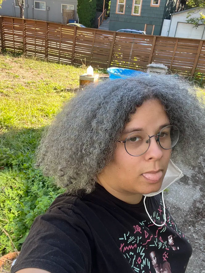 Fundraiser by Clara Emiliana : Support Clara's Surgery Recovery (FFS)