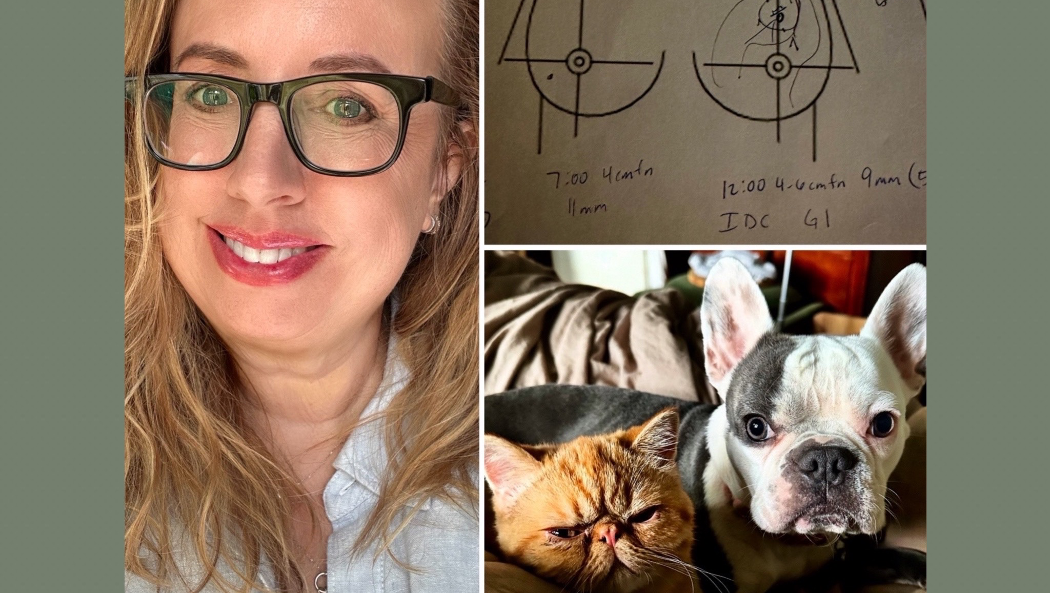 Fundraiser by Cora Potter : Help Cora Survive and Thrive - Breast Cancer