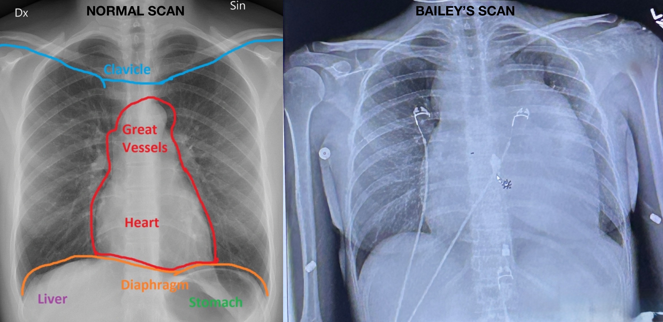 Fundraiser for Bailey Wells by Steven Wells : Help A Young Mother Fight ...