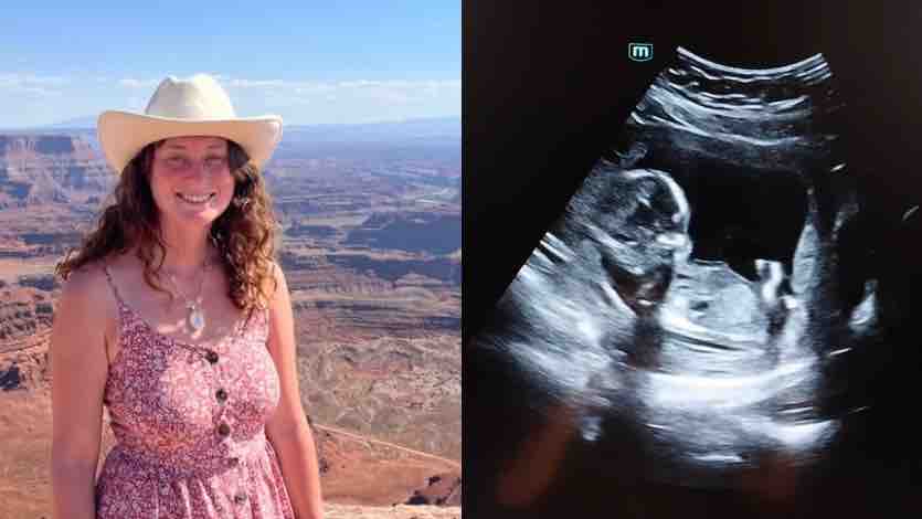 Fundraiser by Heidi Fergus : Support Heidi’s Birth & Baby Fund