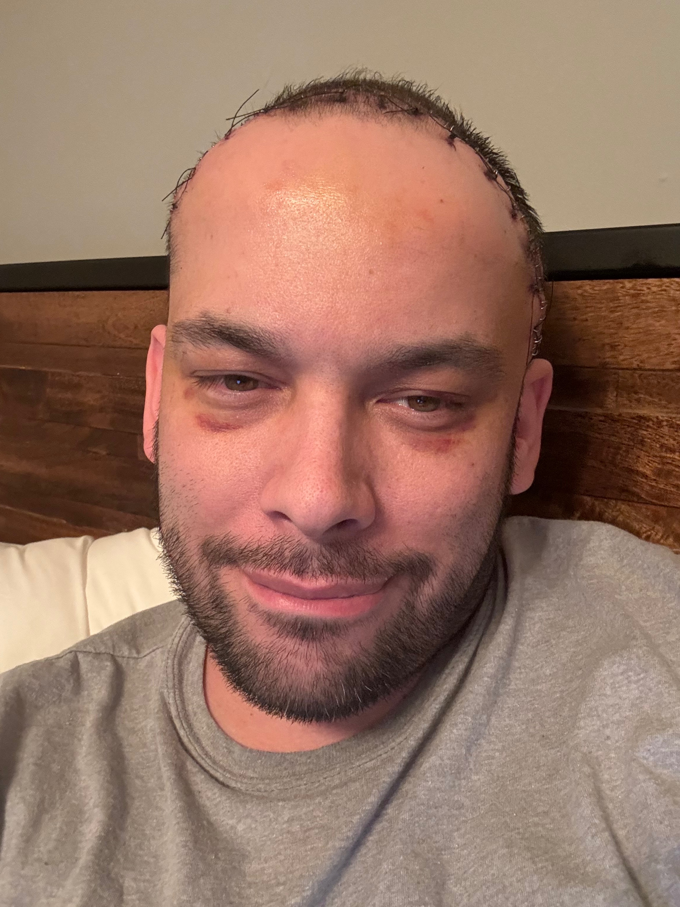 Fundraiser by Lee Gizzarelli : Support Lee's Recovery from Brain Tumor ...