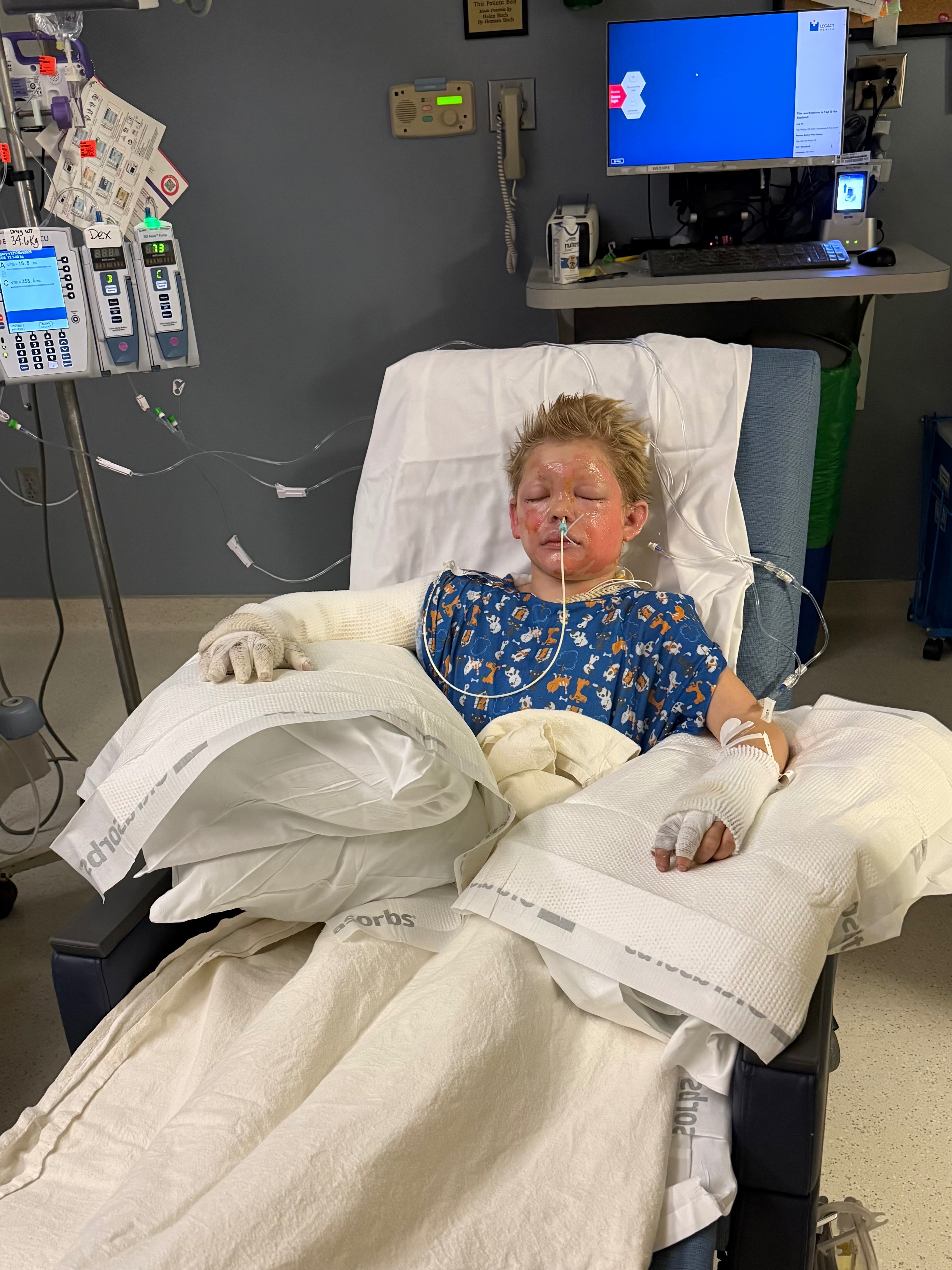 Fundraiser by Kaitlin Walker : Support Gabe's Recovery from Burn Injuries