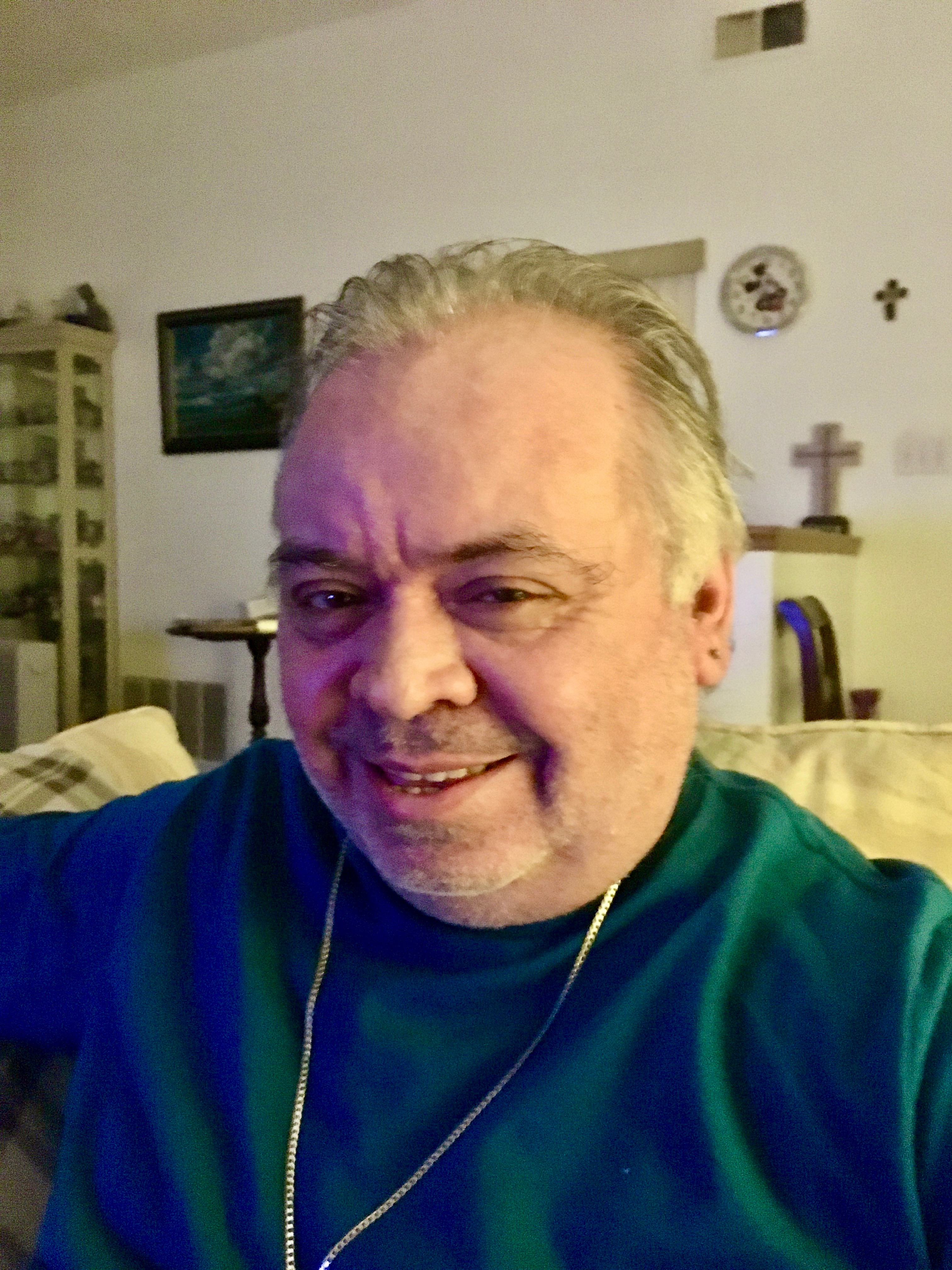 Fundraiser by Richard Yates : Restore Richard's Smile: Dental ...