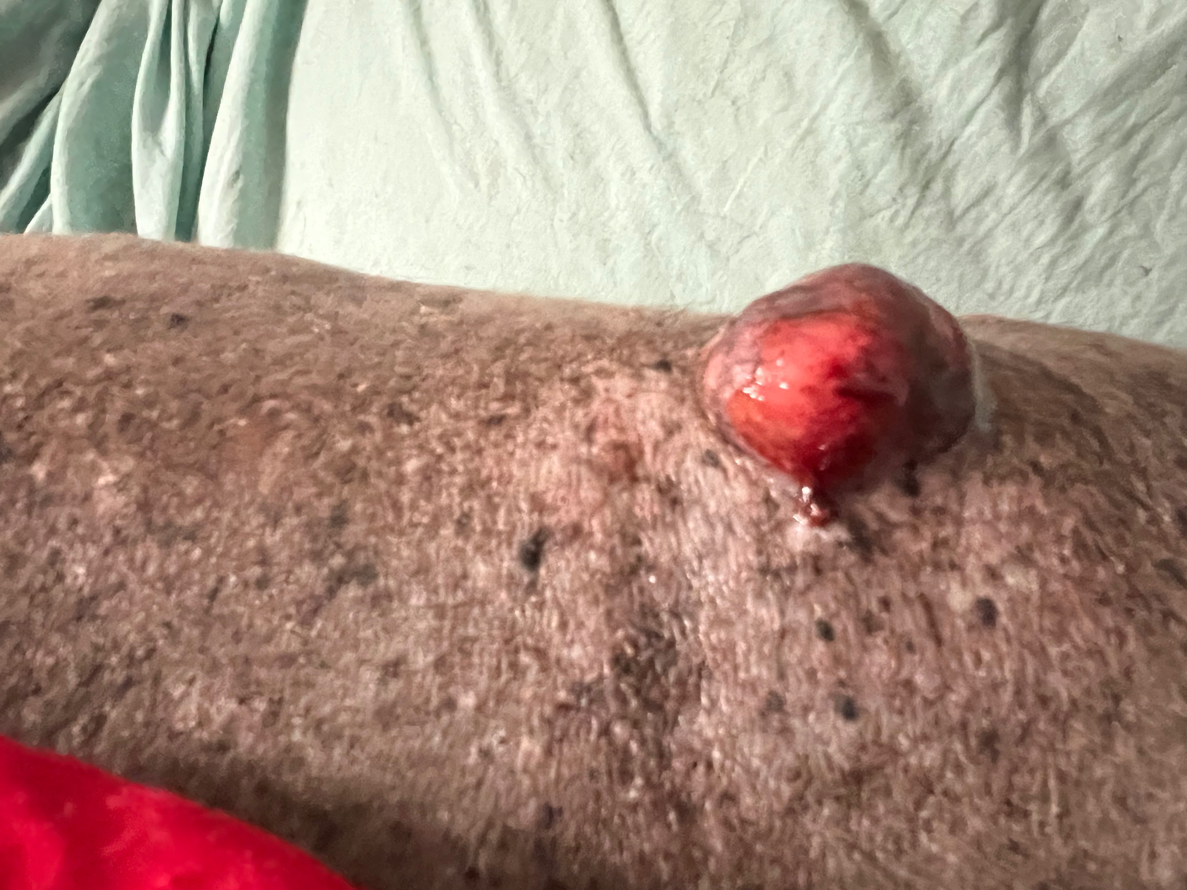 Fundraiser for Nicole Barone by Mary Jo Pasquarella : Support Nikki's ...