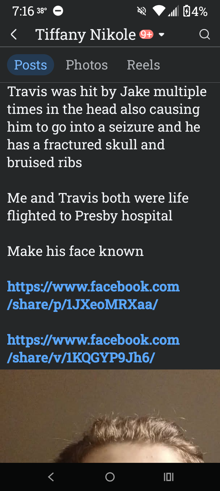 Fundraiser by Travis Soloski : Mercer Street Attack