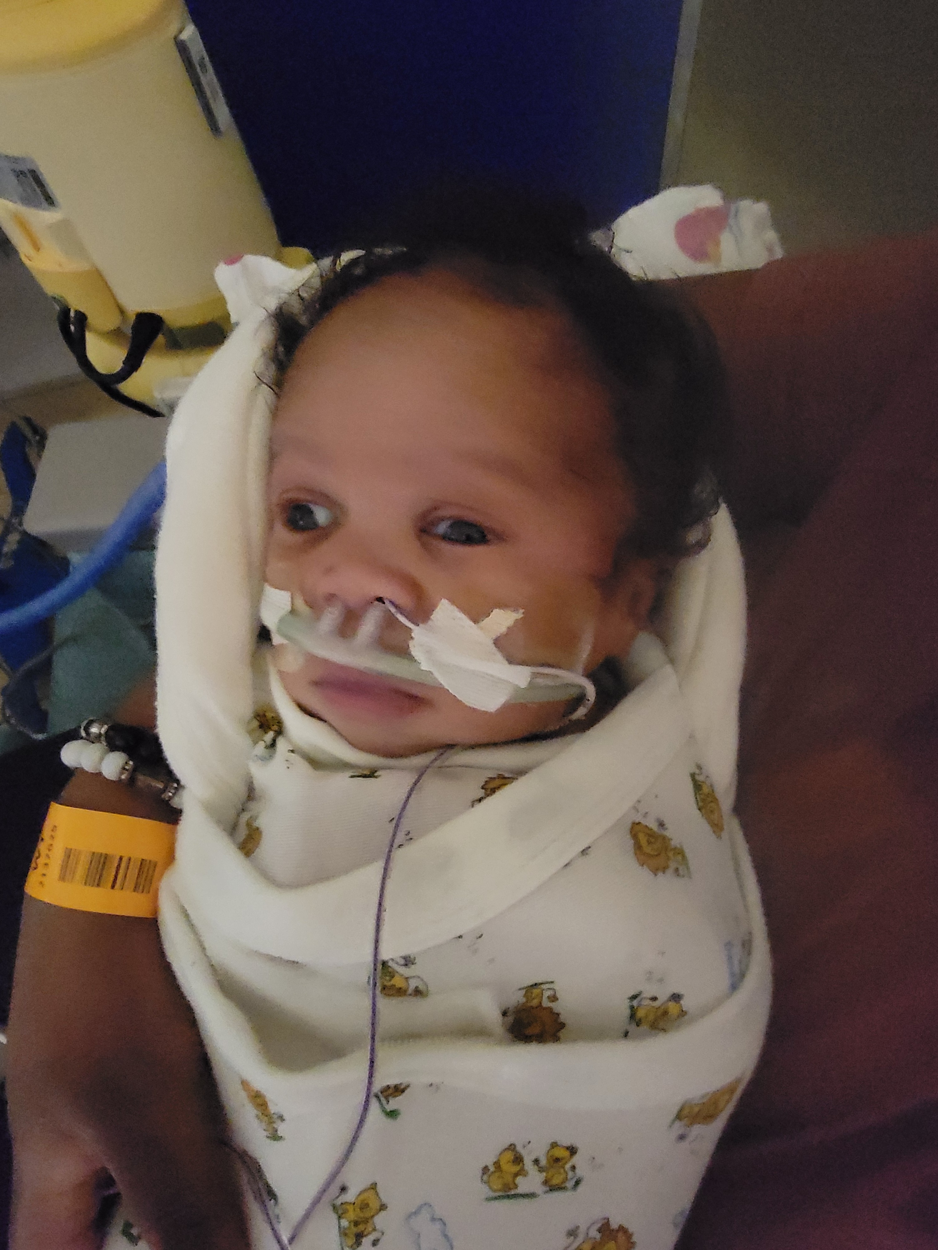 Fundraiser by Moet Drisdale : Donate to Nylah's Critical Surgery and Care