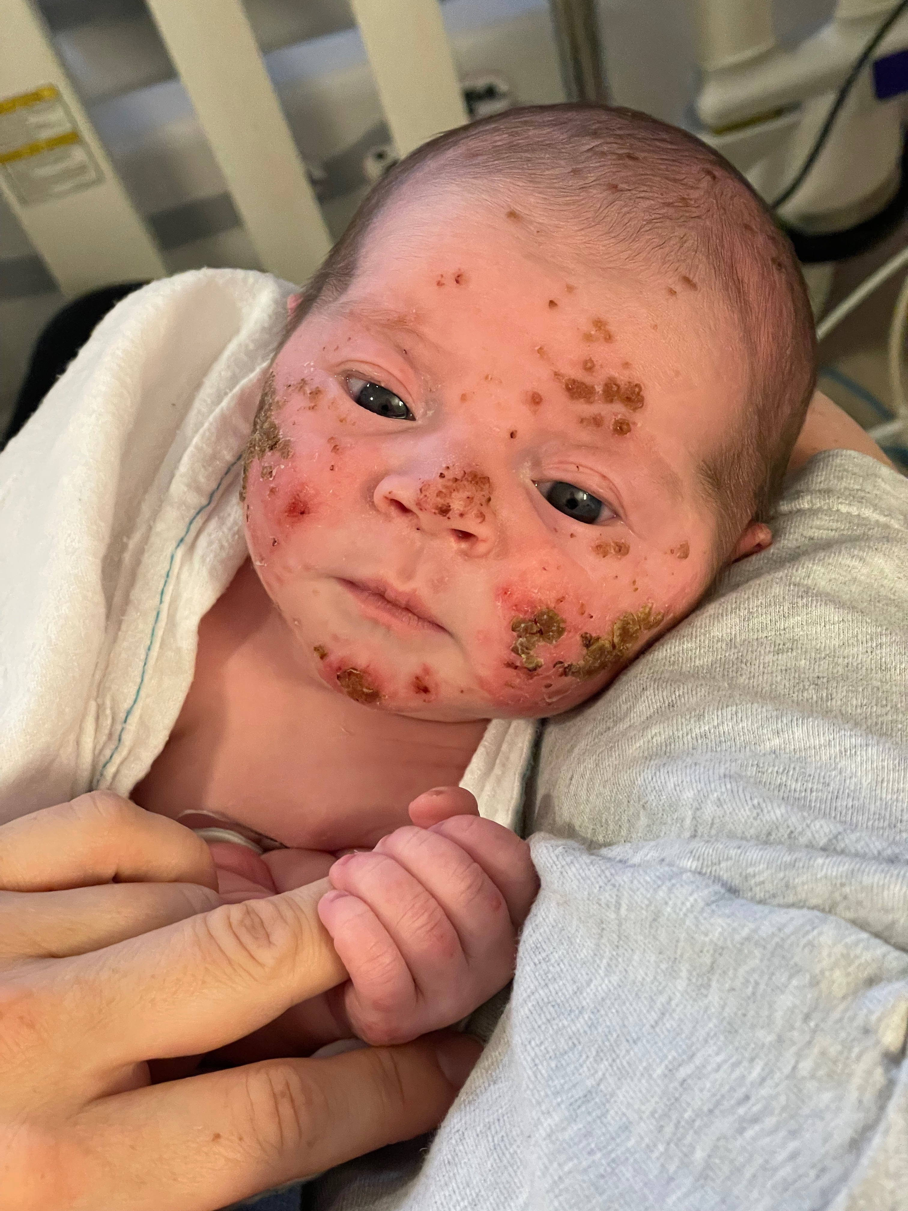 Fundraiser by Aid for Alexander : Support Alex’s Fight With Lifesaving ...